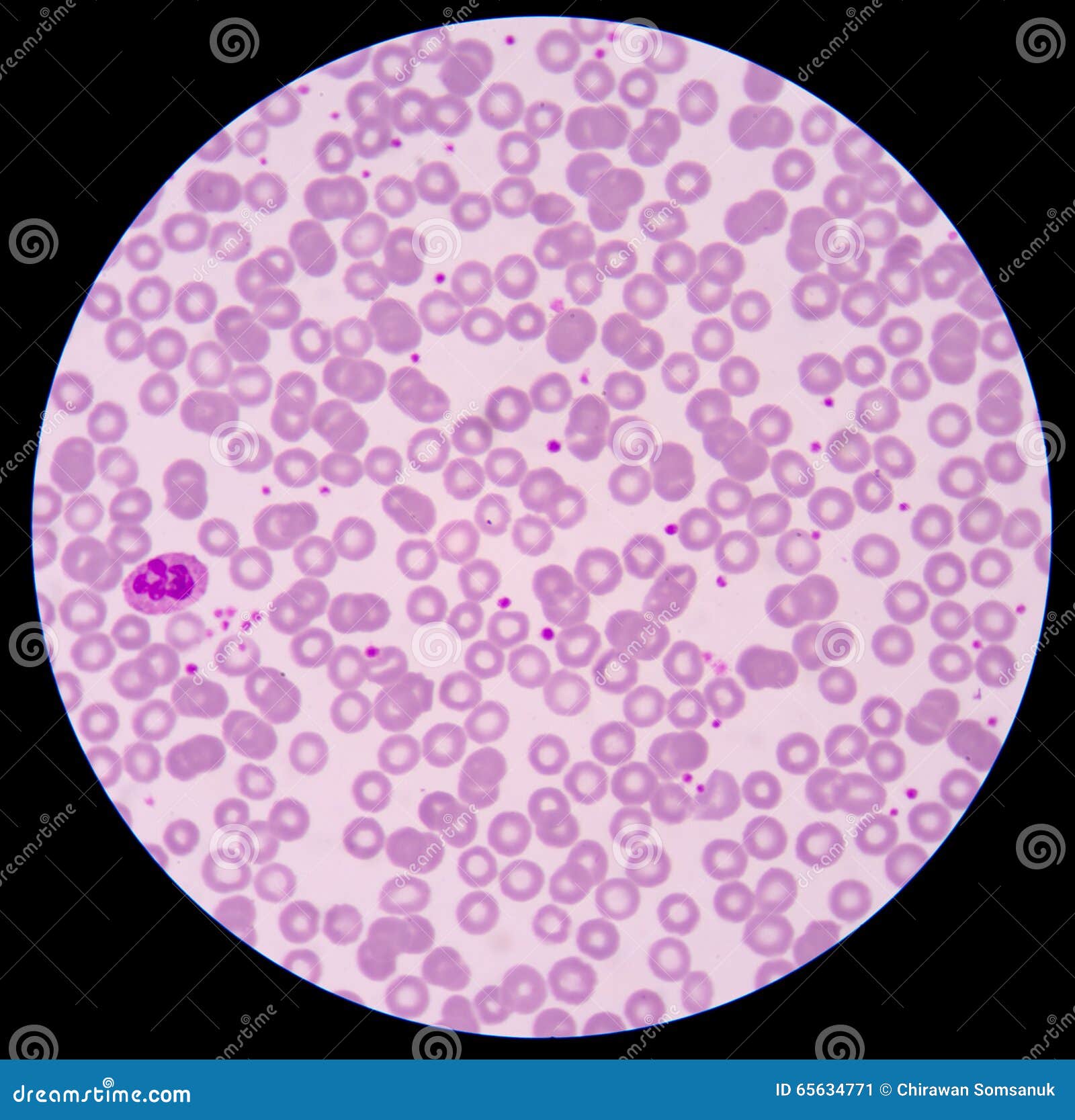 Blutausstrich stock abbildung. Illustration von lappig - 65634771