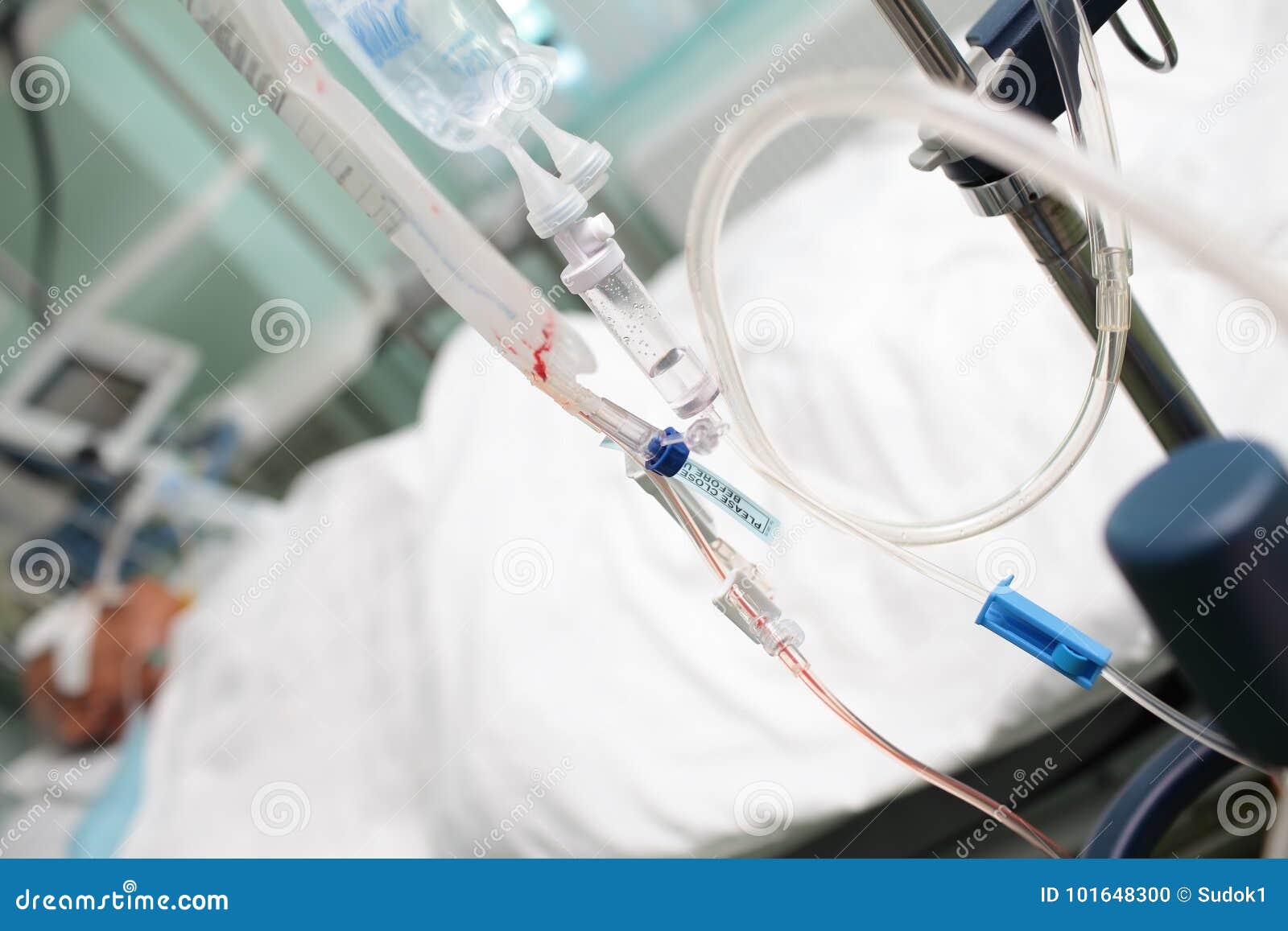 Bluttransfusion Zum Unbewussten Patienten Stockfoto - Bild von ...