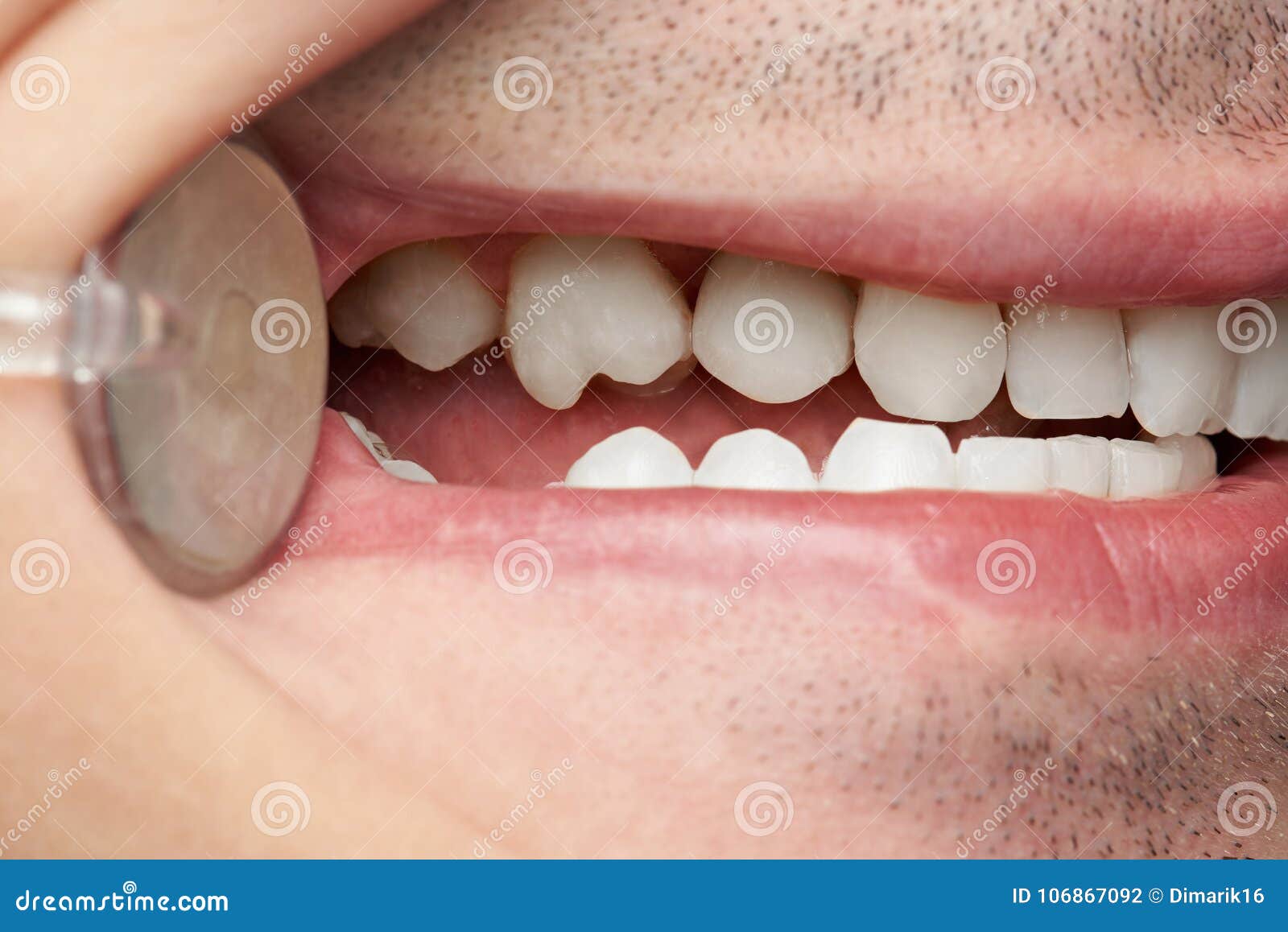 Boca Cerrada Con Los Dientes Blancos Limpios Foto de archivo - Imagen ...