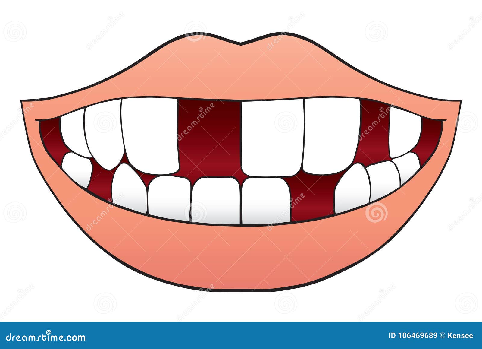 Boca com dentes faltantes ilustração do vetor. Ilustração de bordos ...