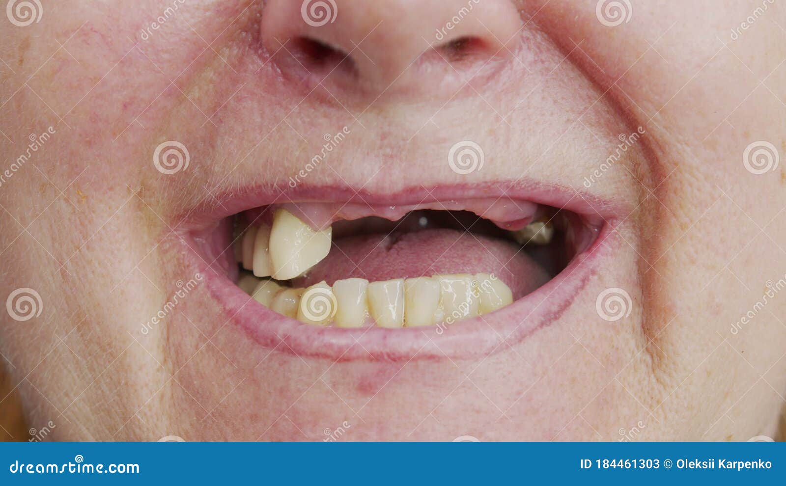 Boca Sin Dientes Cerrada De Una Mujer. Almacen De Video - Vídeo de malo ...