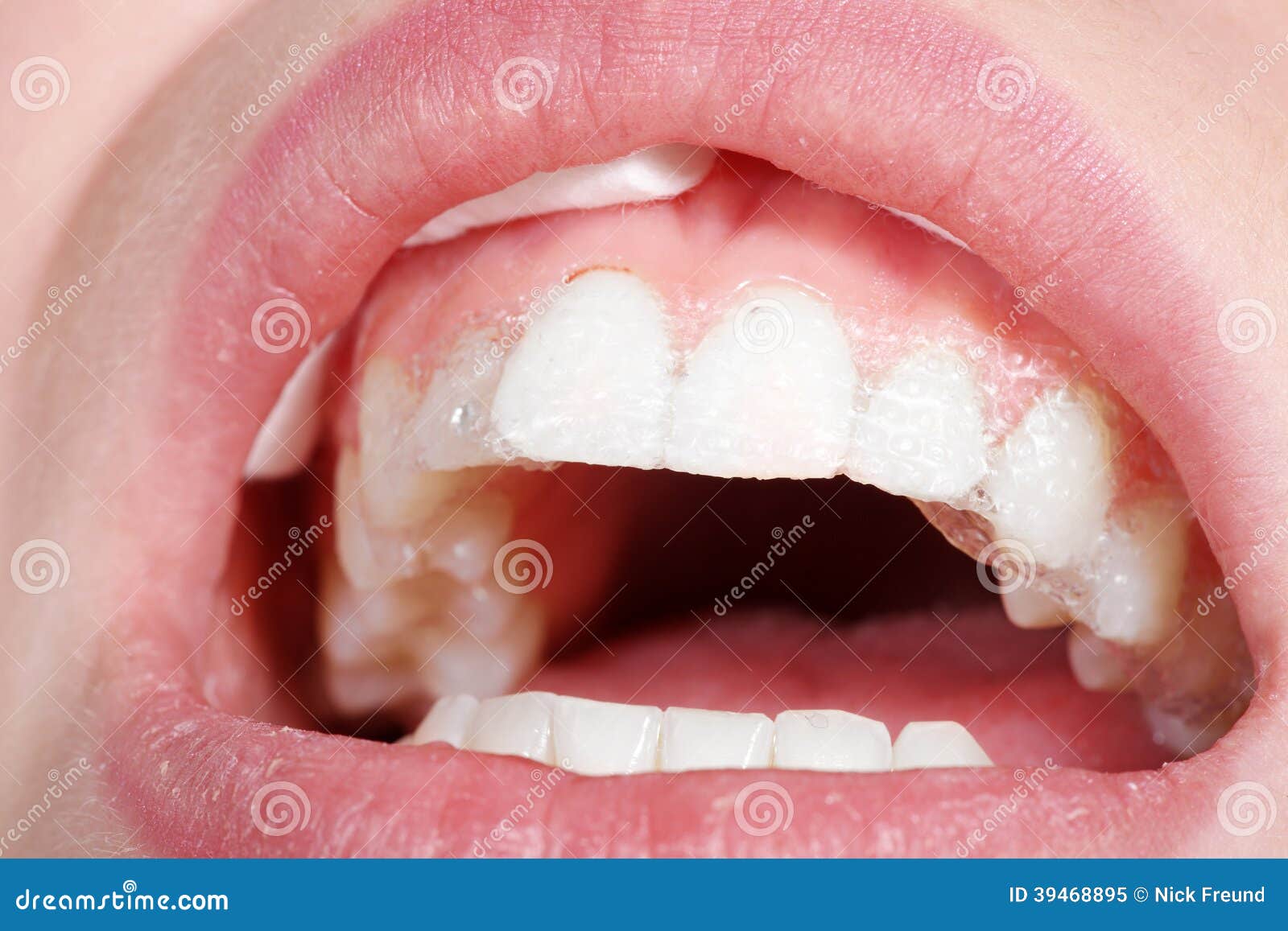 Boca y dientes del primer imagen de archivo. Imagen de cara - 39468895