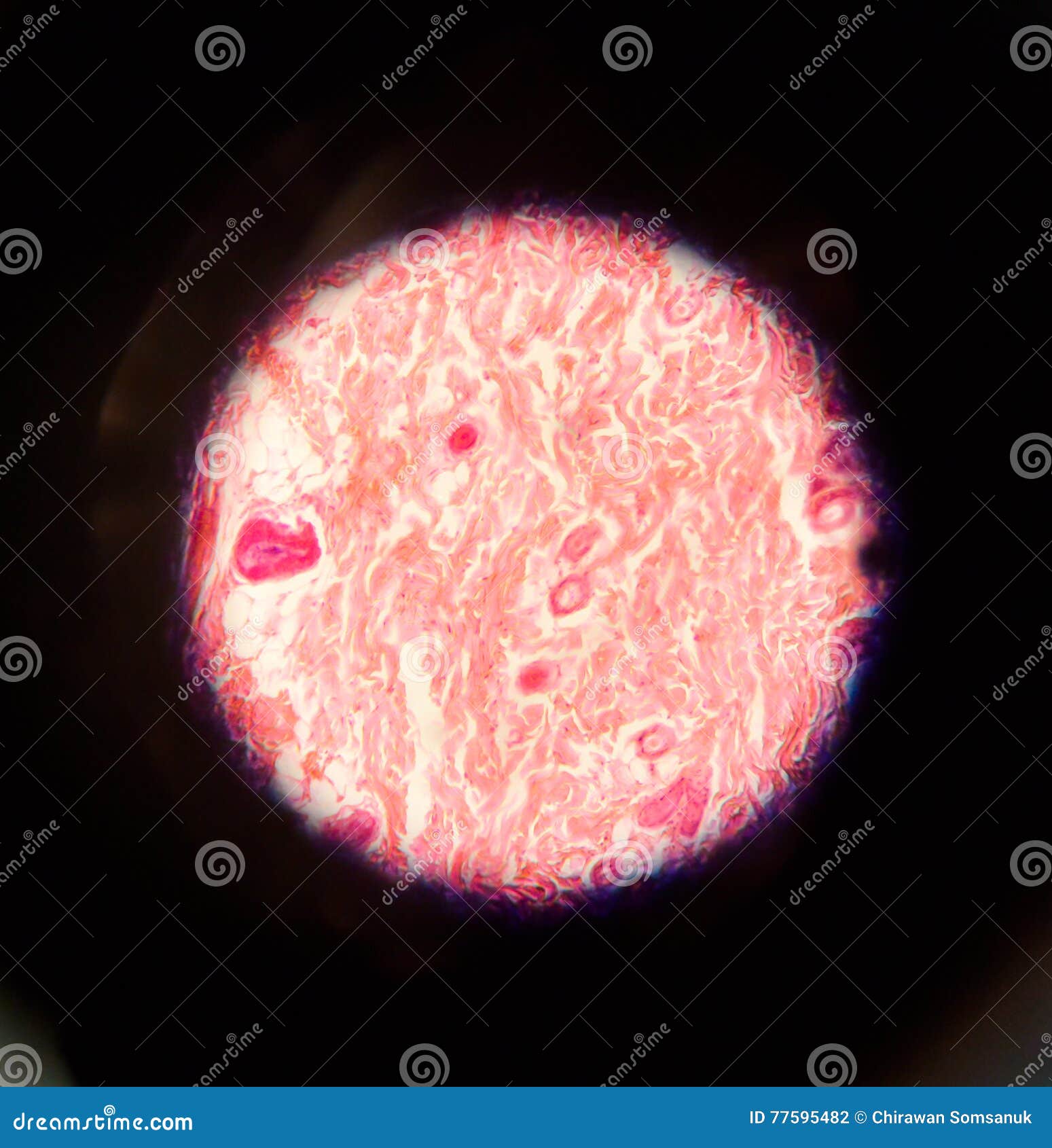 Body cells human stock photo. Image of lymphocyte, cytotoxic - 77595482