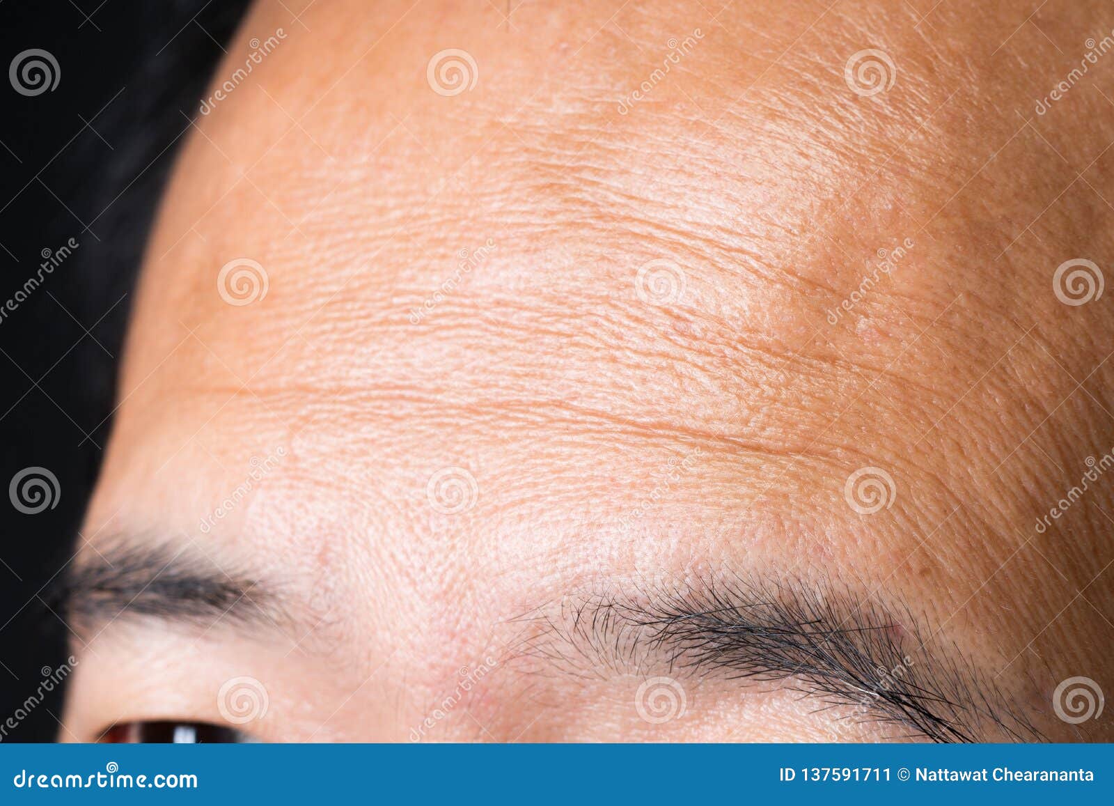 Body Part Asian Skin Forehead Stock Image - Image of closeup, male ...