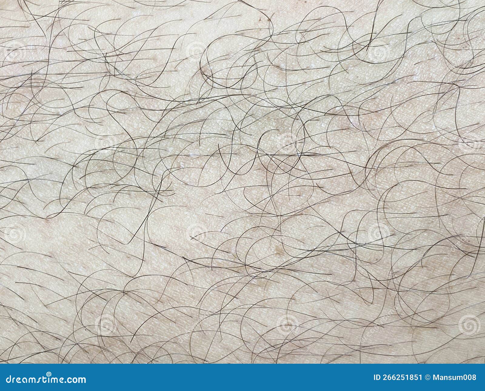 Body skin texture stock image. Image of injury, closeup - 266251851