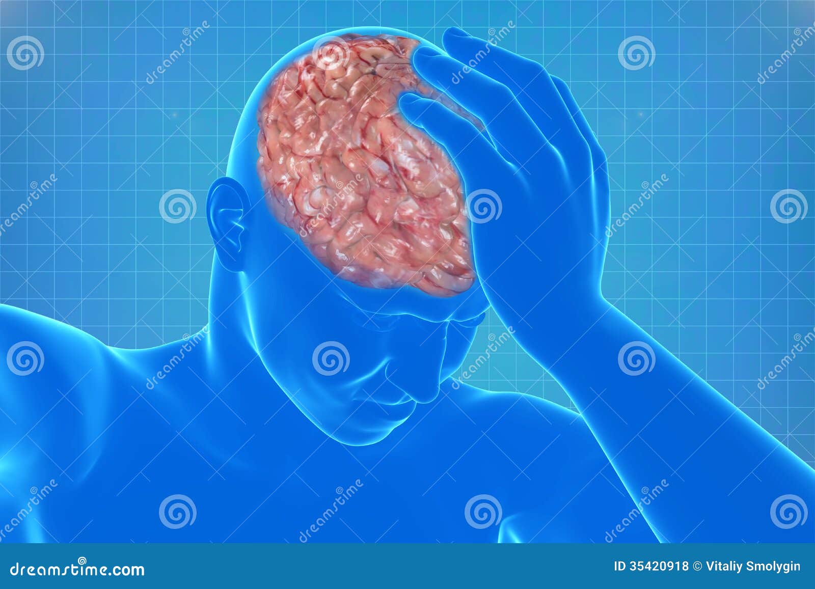 Body with visible headache stock illustration. Illustration of anatomy ...