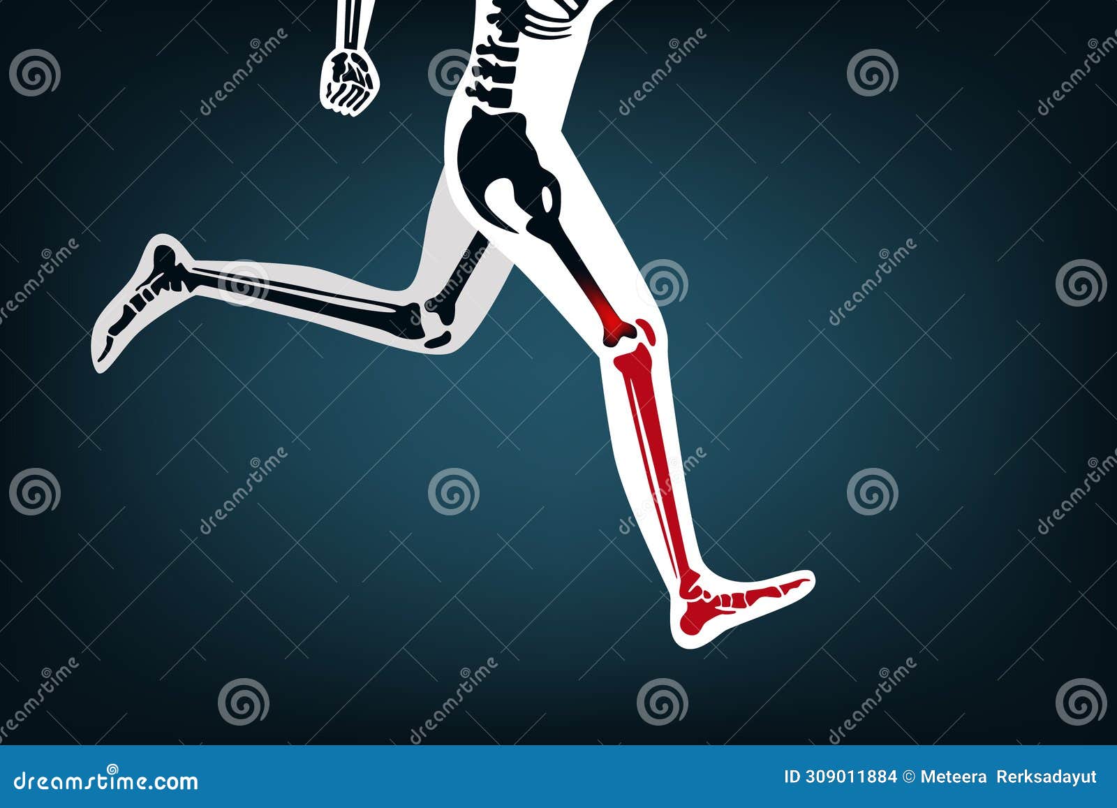 Pain In The Bone Or Office Syndrome, Or Caused By Prolonged Work Stock ...