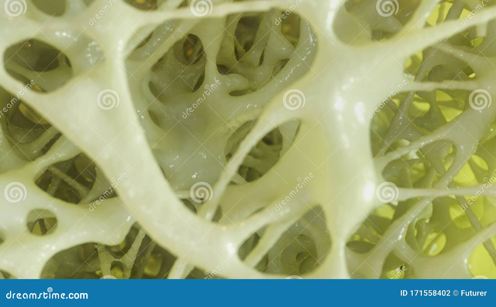 Bone Affected With Osteoporosis Cross Section 3d Rendering Stock