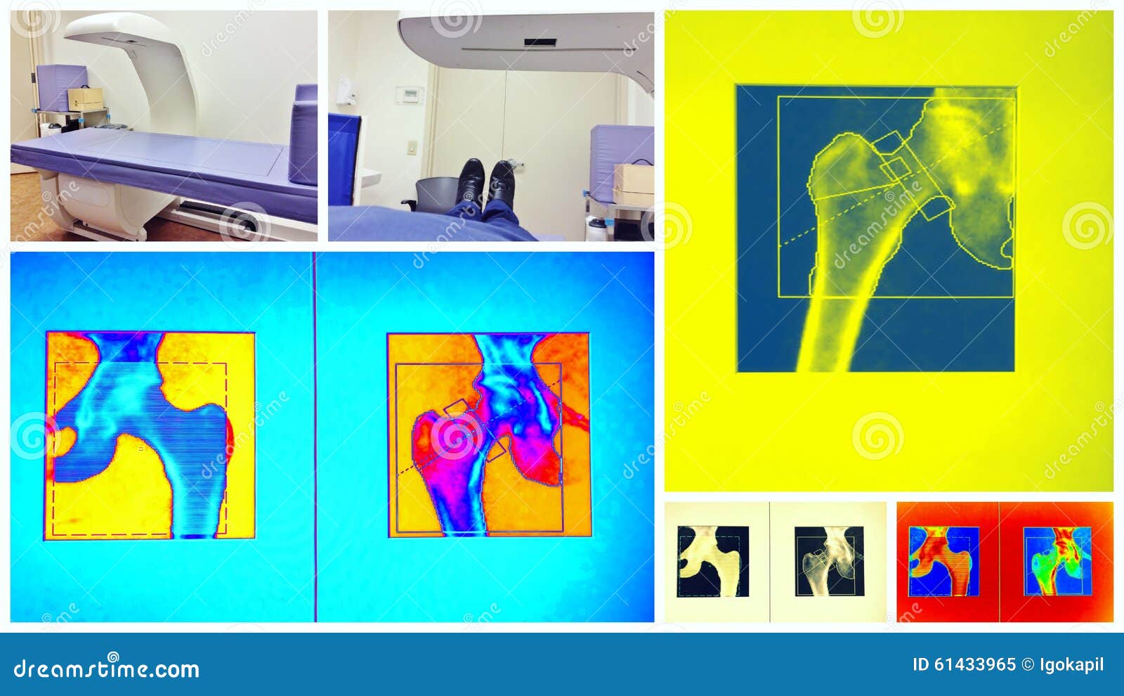 Bone Density Scan Colorful Collage Stock Image - Image of radiology ... Bone Density Scan Colorful Collage Stock Image - Image of radiology ...