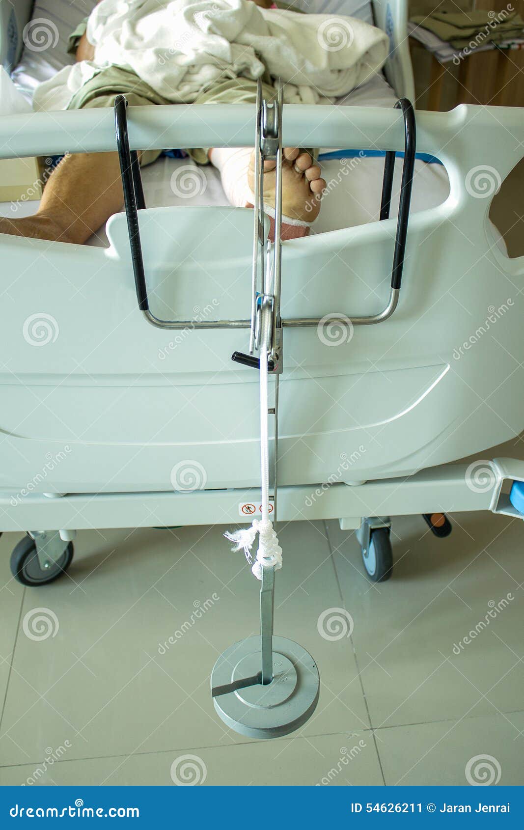 Bone Fracture Royalty-Free Stock Photo | CartoonDealer.com #54626211