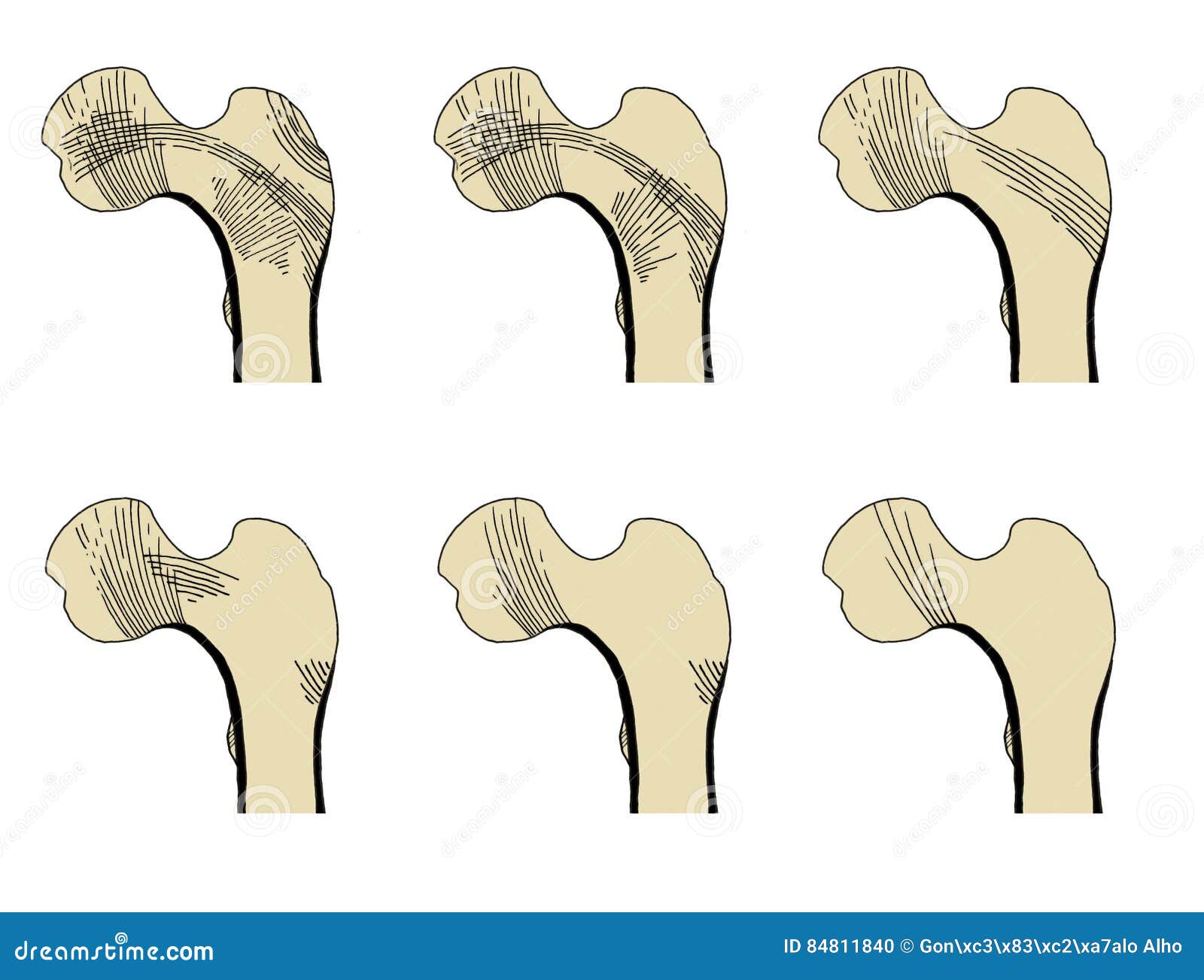Restoration Of Bone System Icon. Element Of Treatment With Name For ...