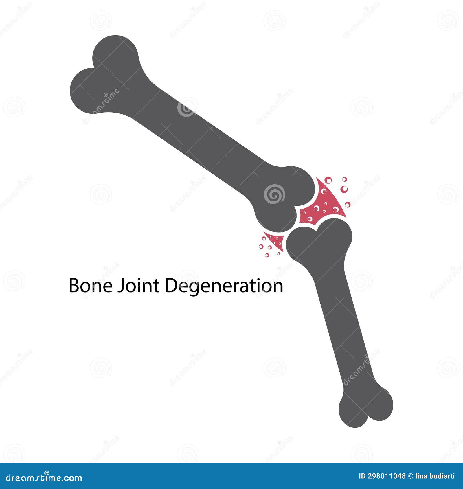 Bone Joint Degeneration Icon Stock Vector - Illustration of medicine ...