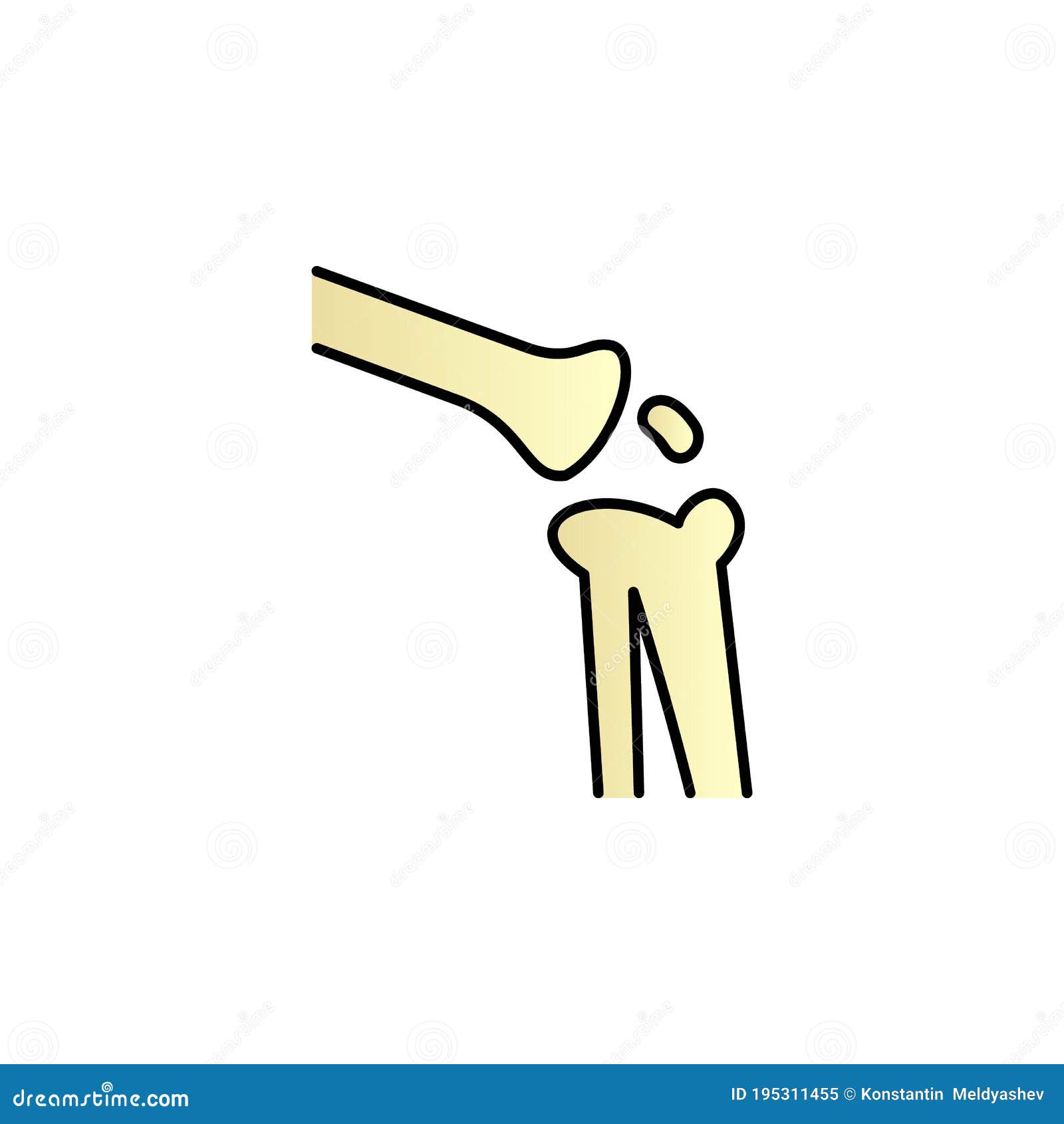 Leg Bone And Knee Lesions, 3d Rendering Stock Image | CartoonDealer.com ...