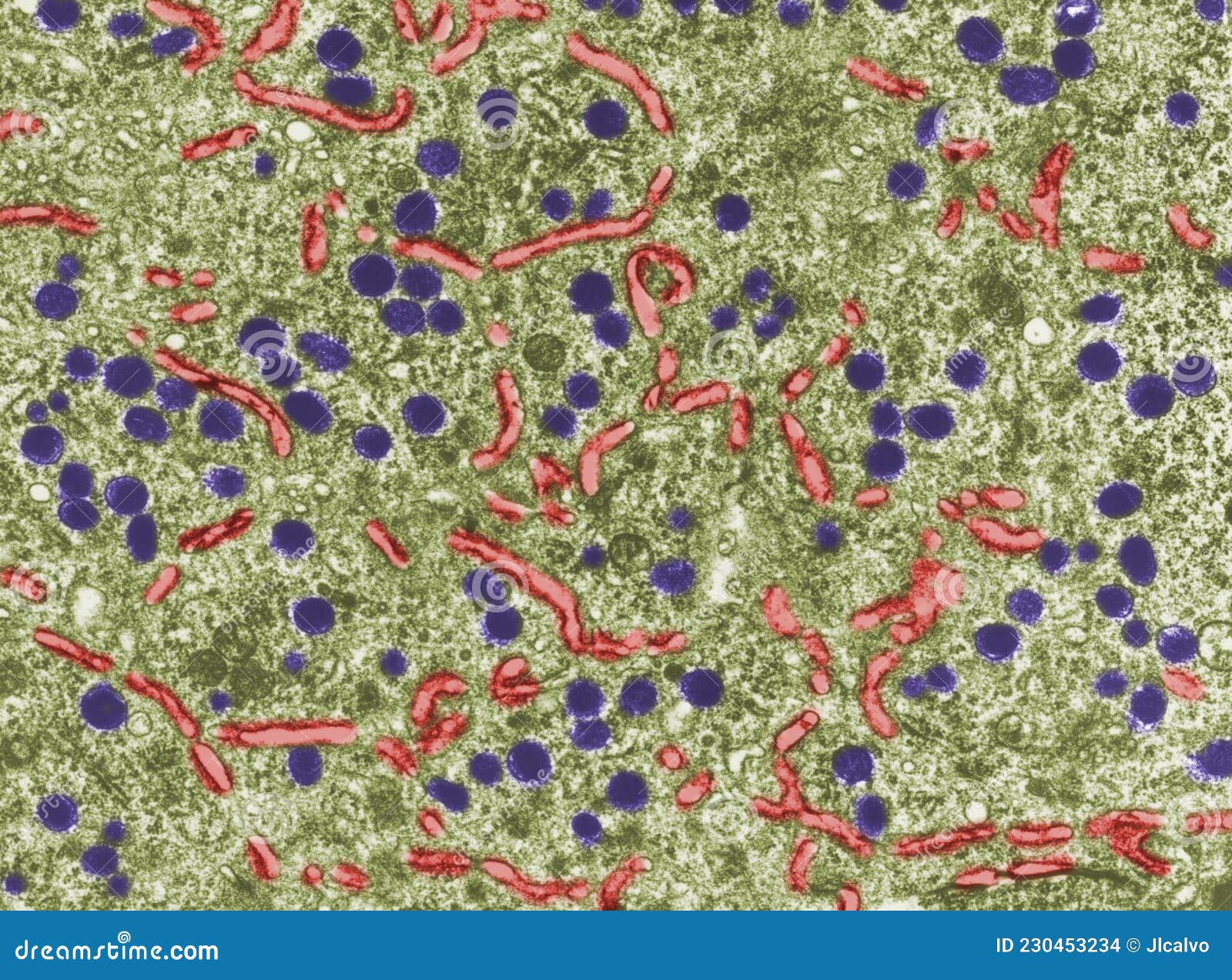 Bone marrow. Megakaryocyte stock photo. Image of cell - 230453234