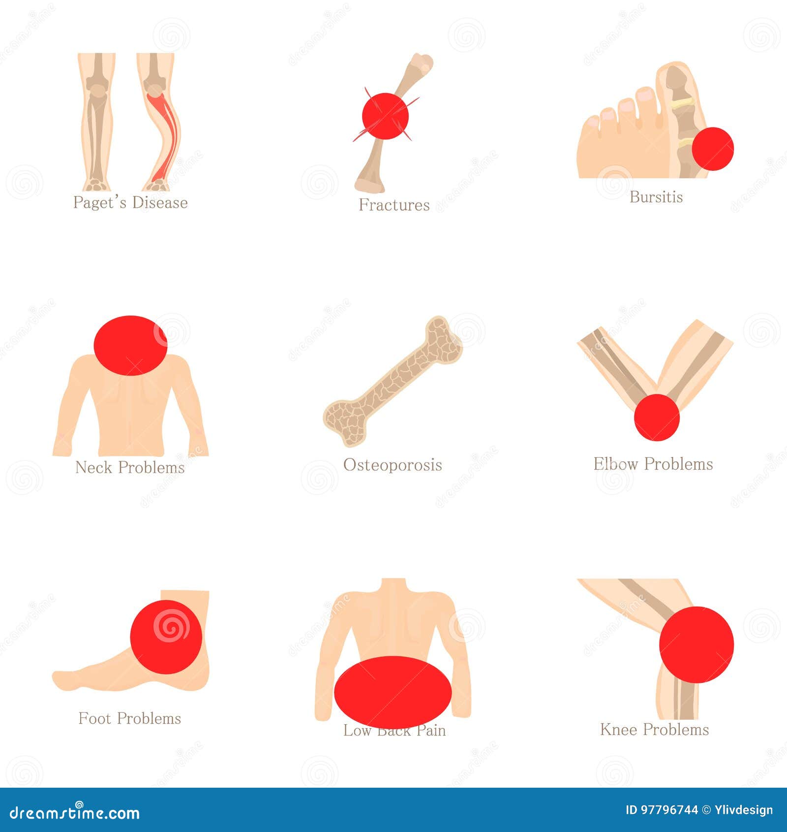 Bursitis Icons Set Vector Illustration | CartoonDealer.com #221525266