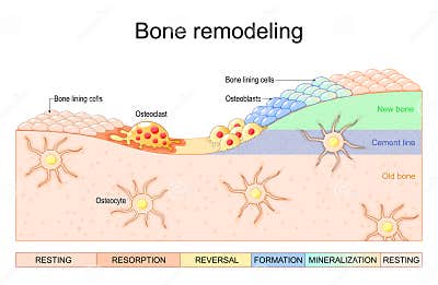 Bone Remodeling Process. Close-up of Osteoblasts, Osteoclast ...