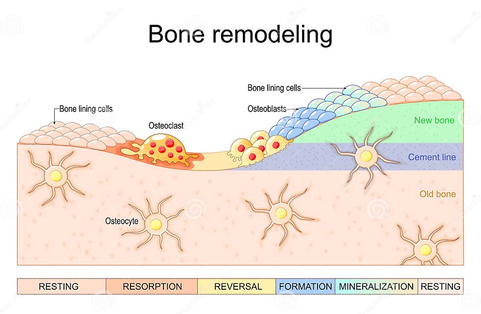 Bone Remodeling Process. Close-up of Osteoblasts, Osteoclast ...