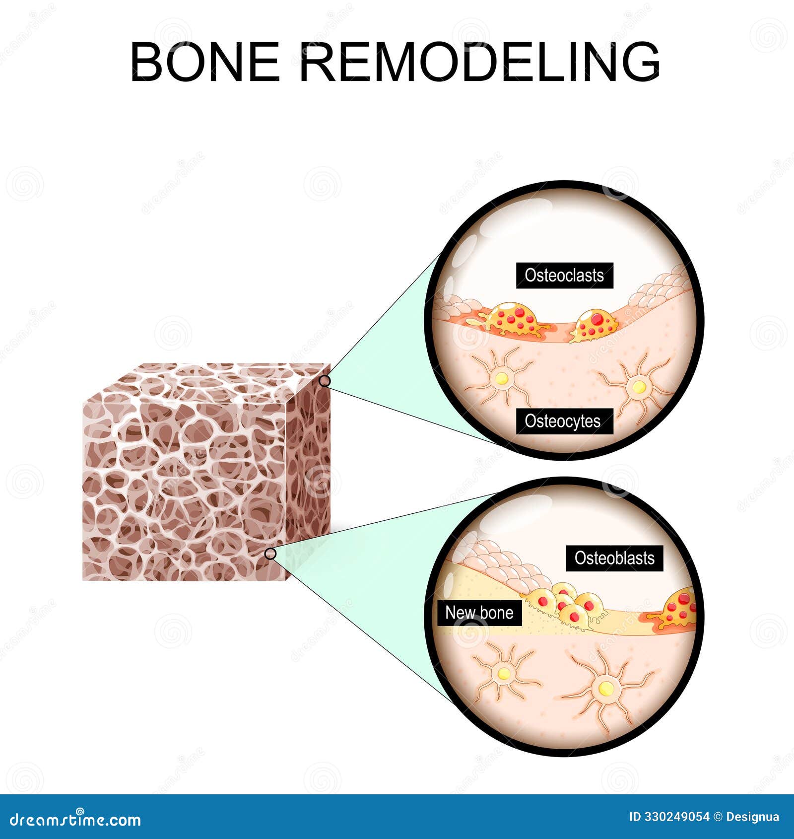Bone Remodeling from Resorption To New Bone Formation Stock Vector ...