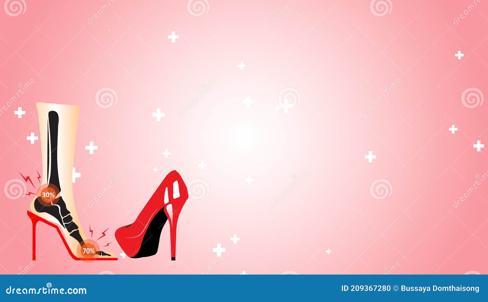 Medical Infographic Orthopedic. Symptom Pain Caused by Wearing High ...