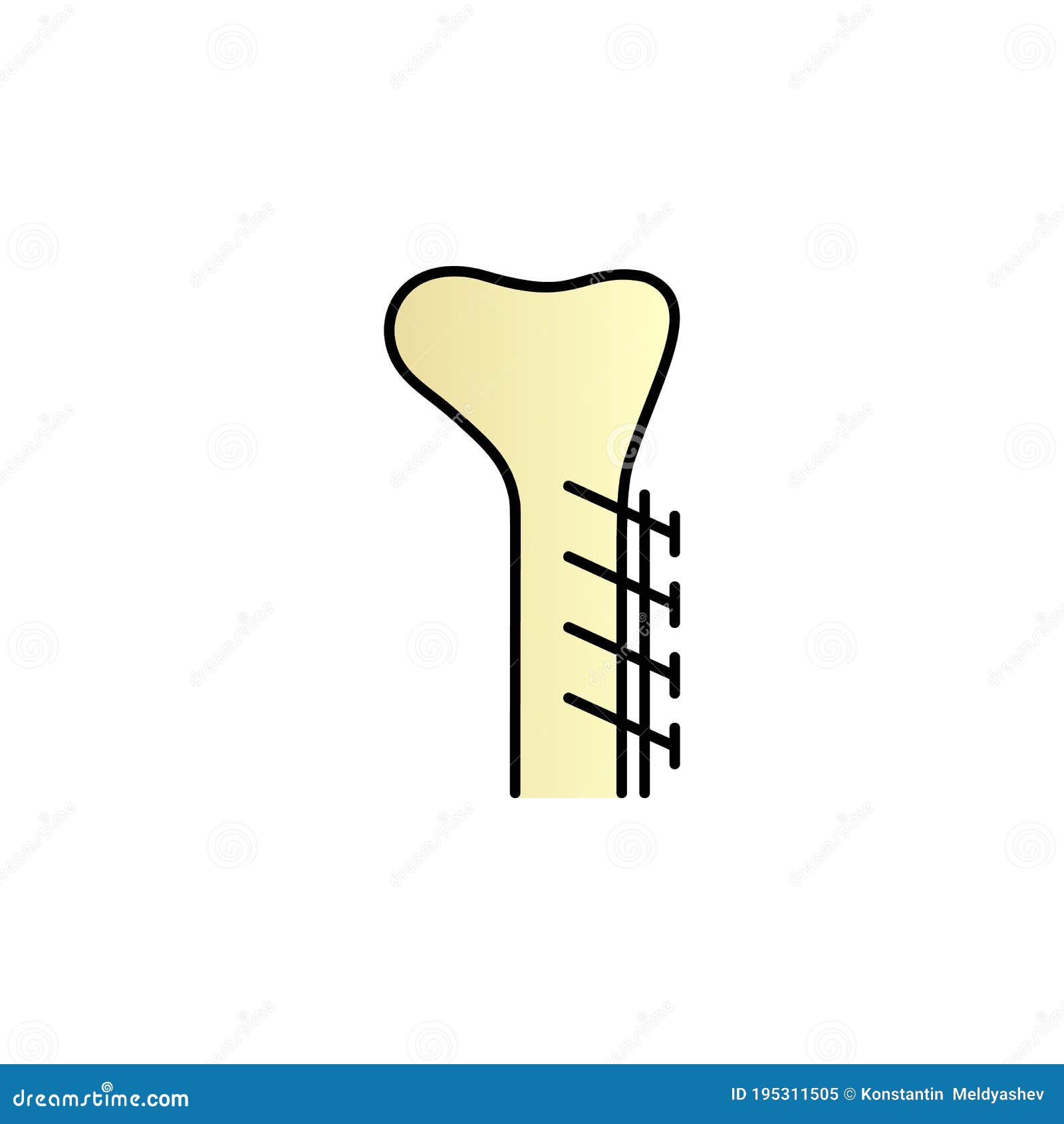Metal Bone Structure Stock Illustration | CartoonDealer.com #147409084