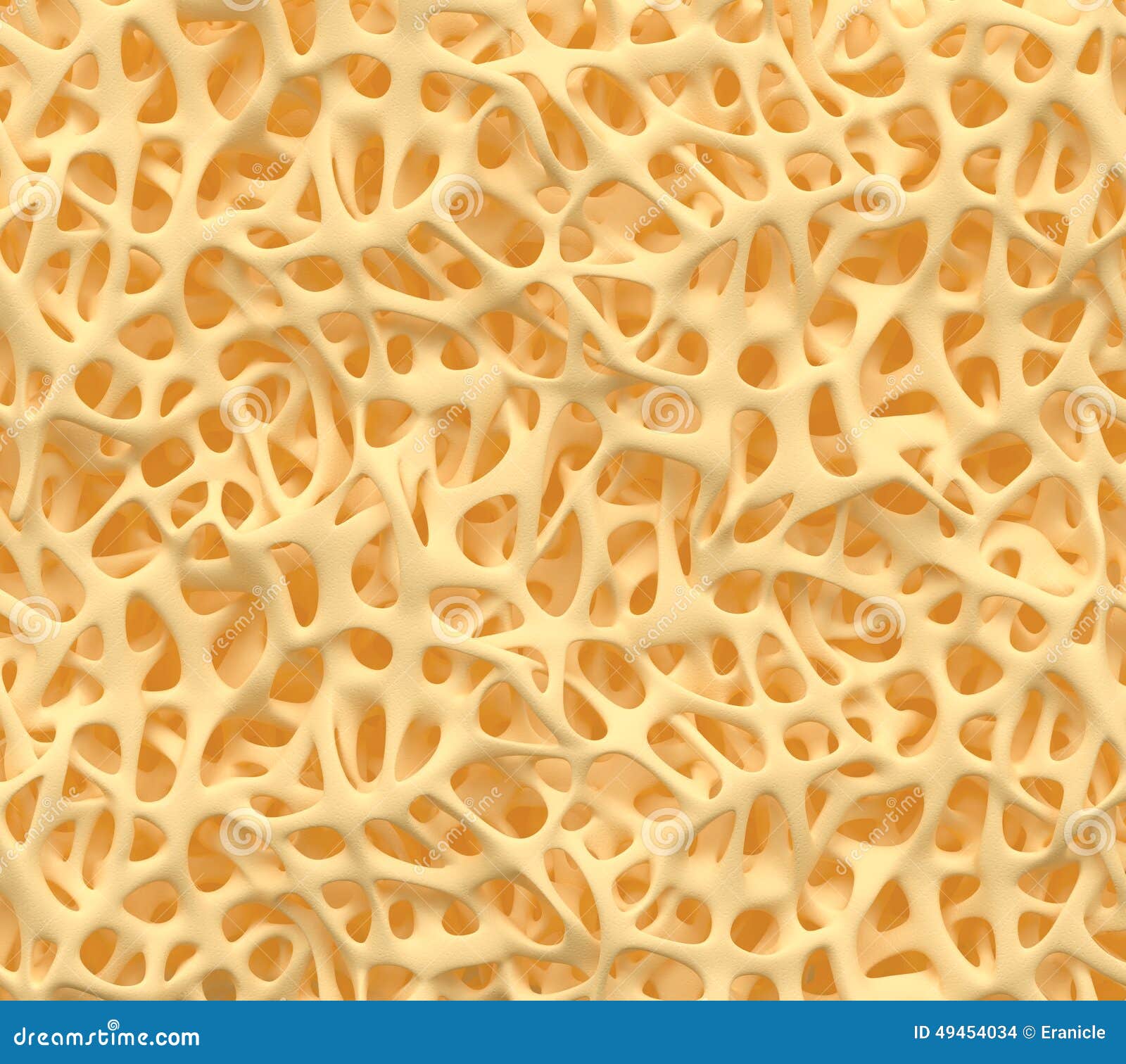 Bone Spongy Structure, Normal And With Osteoporosis Royalty-Free Stock ...