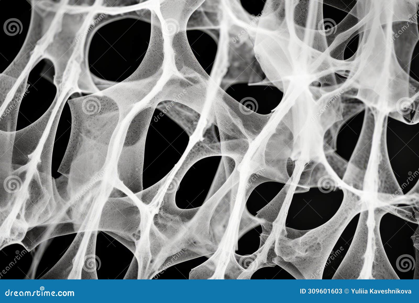 Bone Tissue Human Skeleton Under Microscope Cells Structure Medical ...