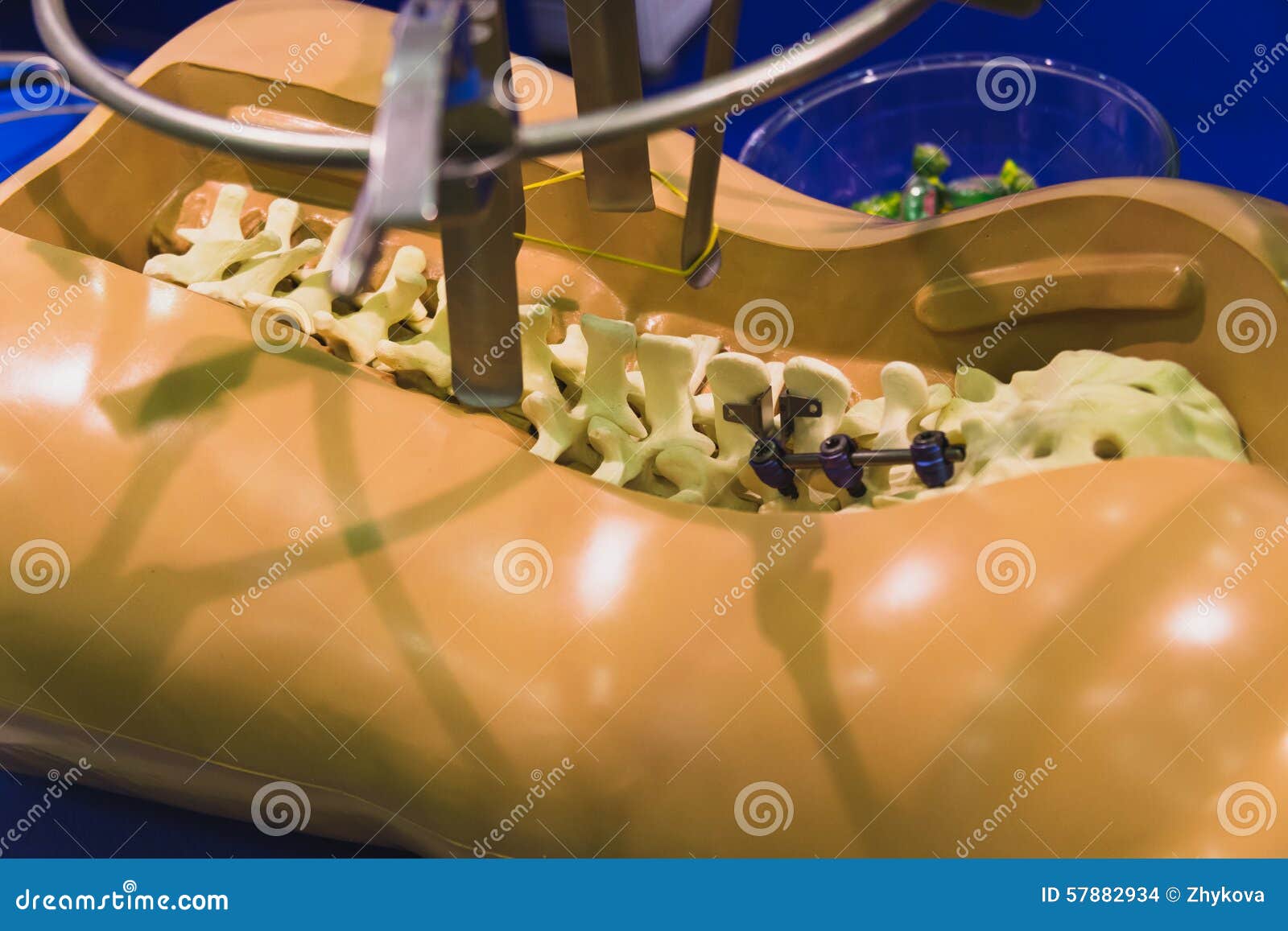 Bones layout stock photo. Image of medicine, pain, clinic - 57882934