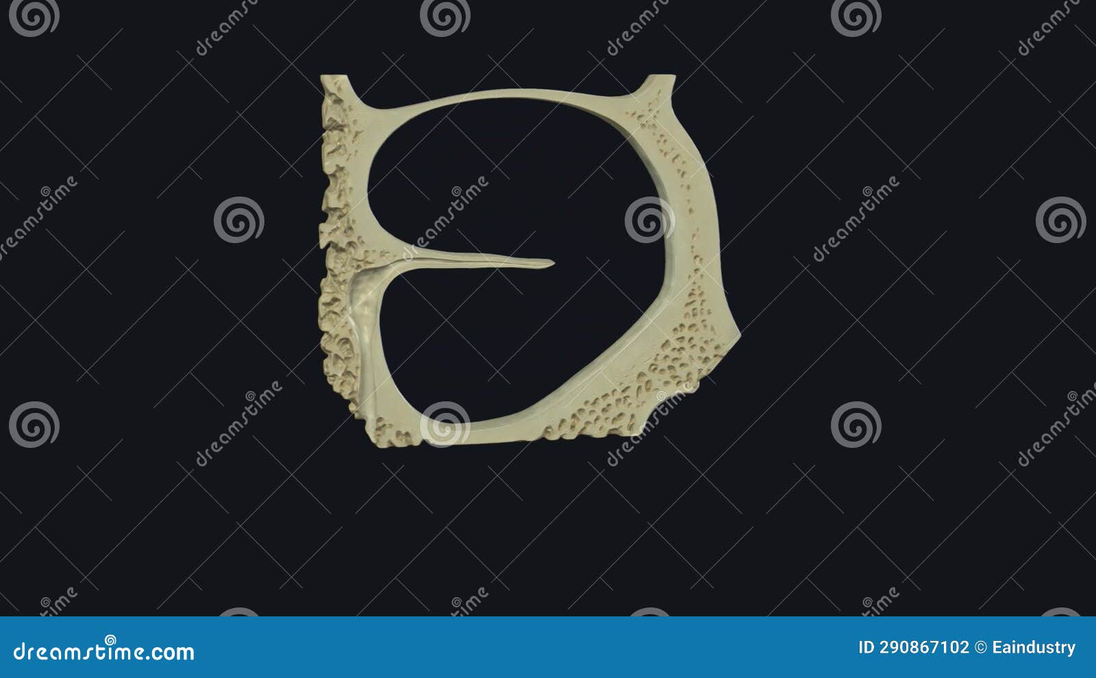 The Bony Labyrinth Contains Perilymph, Which Surrounds the Membranous ...