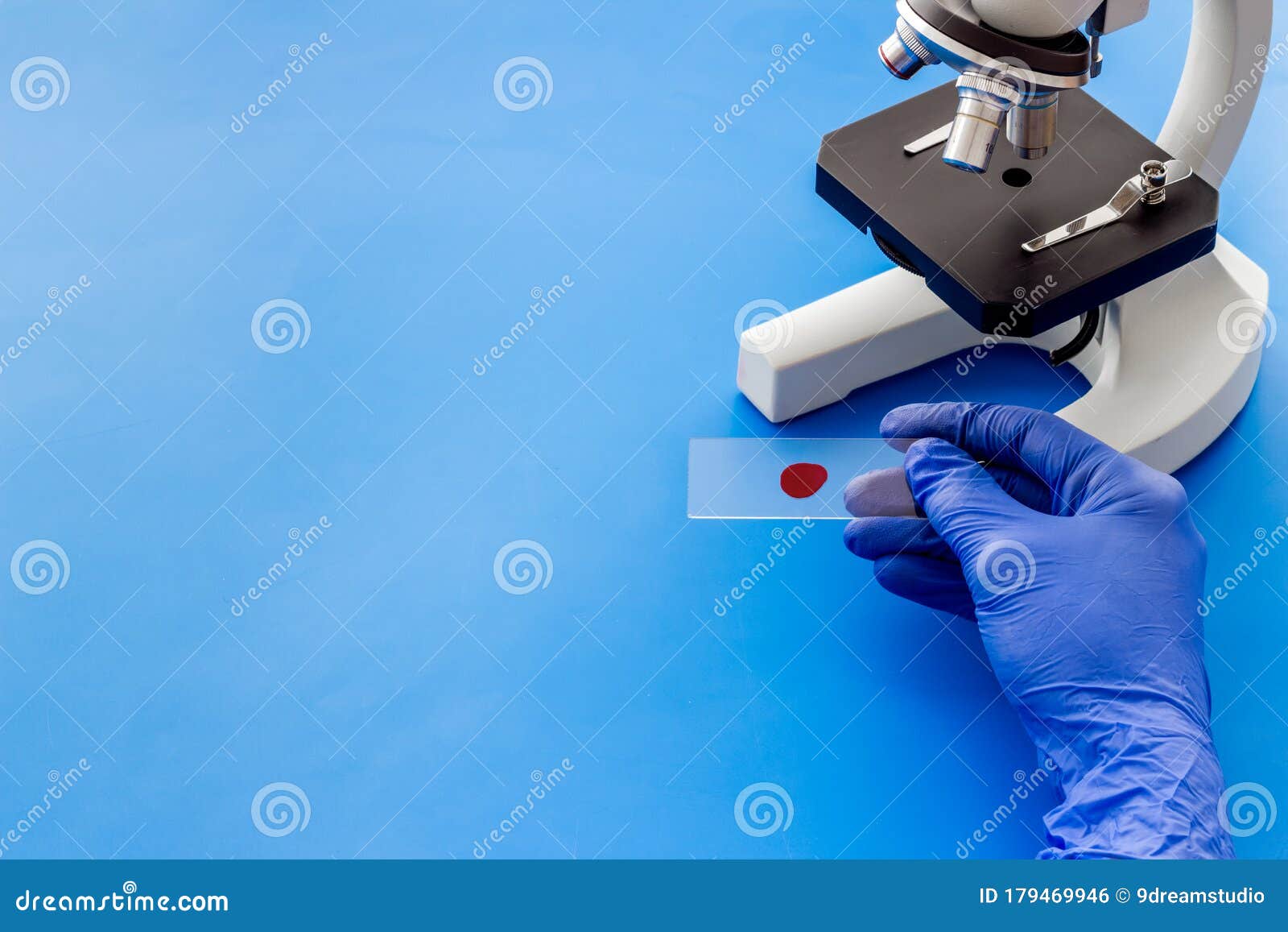 Bood Testing with Microscope in Laboratory. Sample in Hands on Blue ...