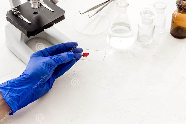 Bood Testing with Microscope in Laboratory. Sample in Hands on White ...