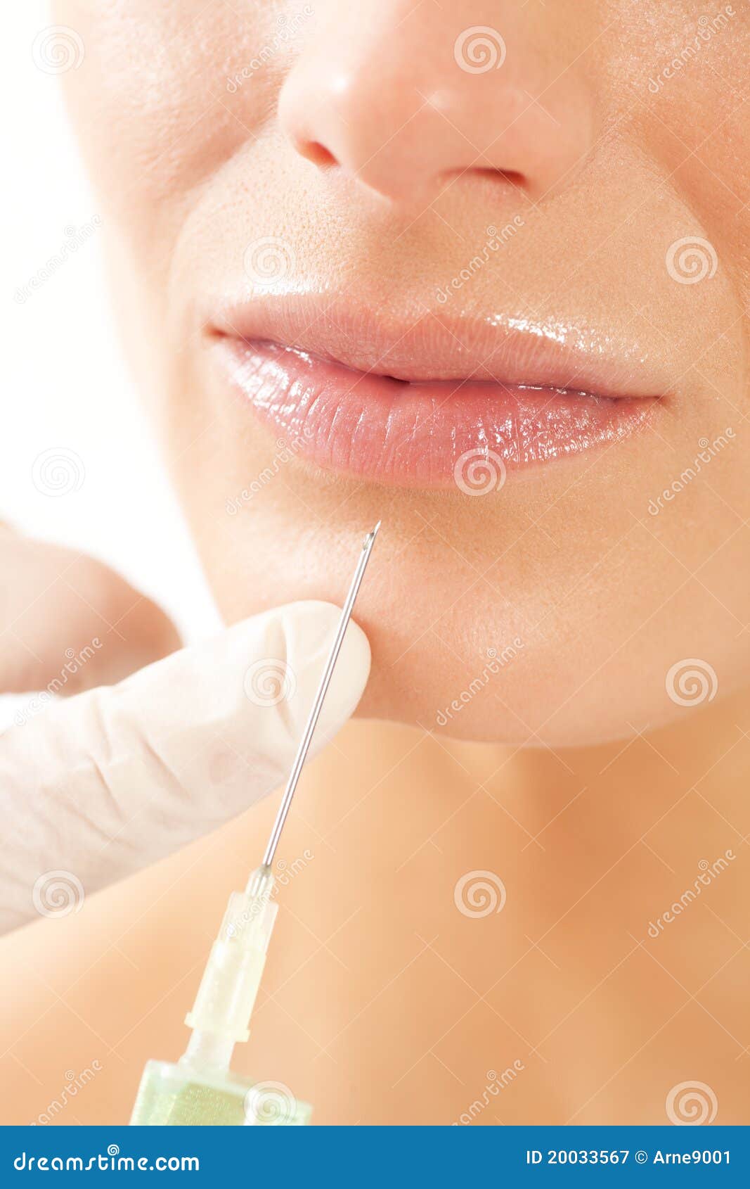Botox - Age and beauty stock image. Image of acid, aesthetic - 20033567