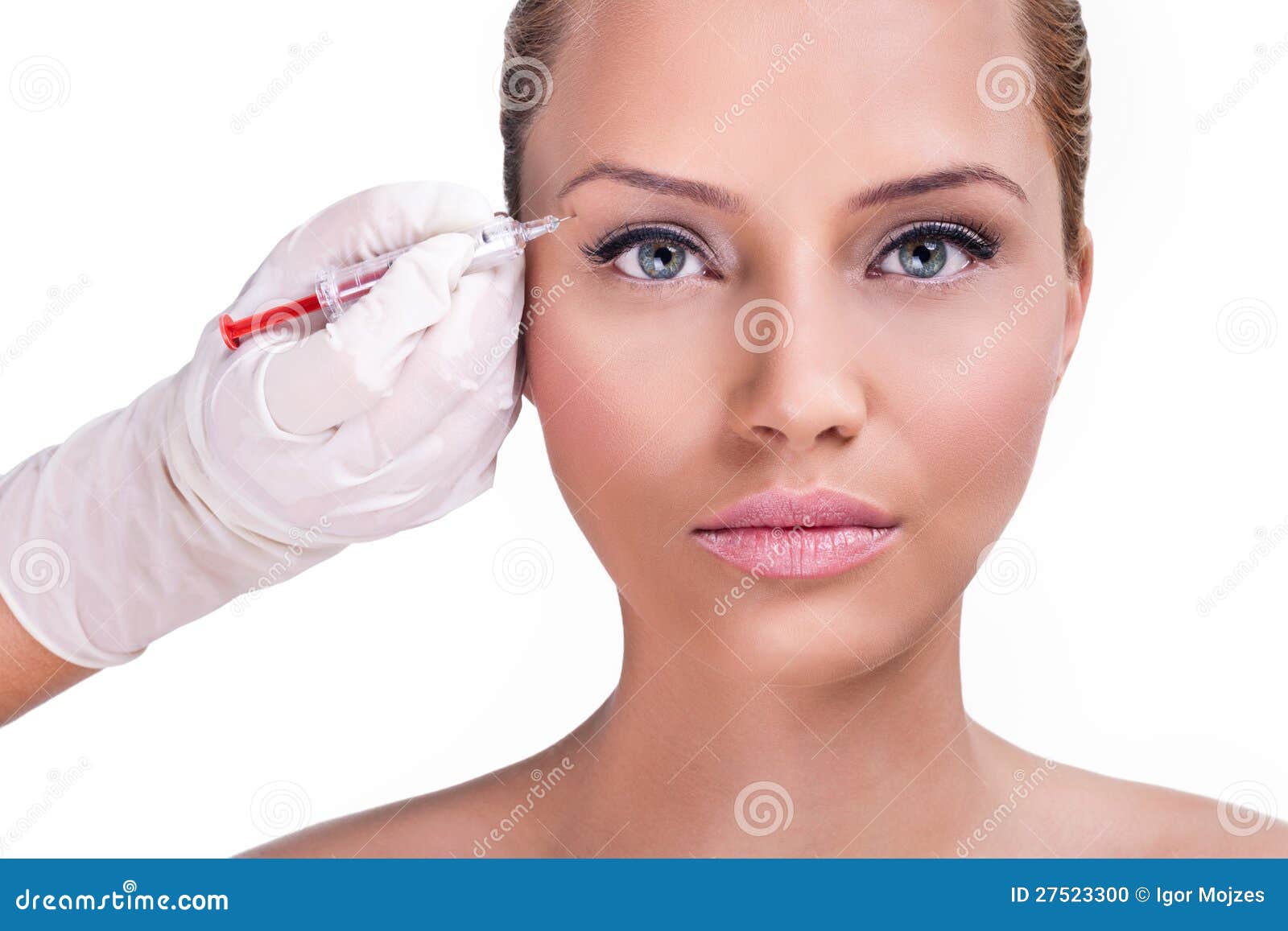 Botox Correction Upper Lids Stock Photo - Image of healthy, aesthetic ...