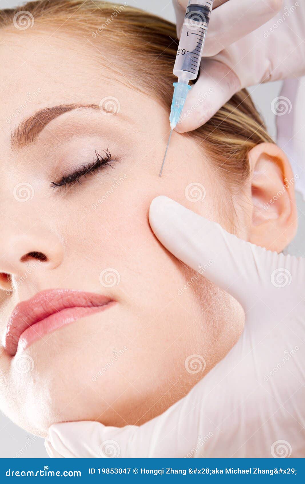 Botox de la cara imagen de archivo. Imagen de piel, humano - 19853047