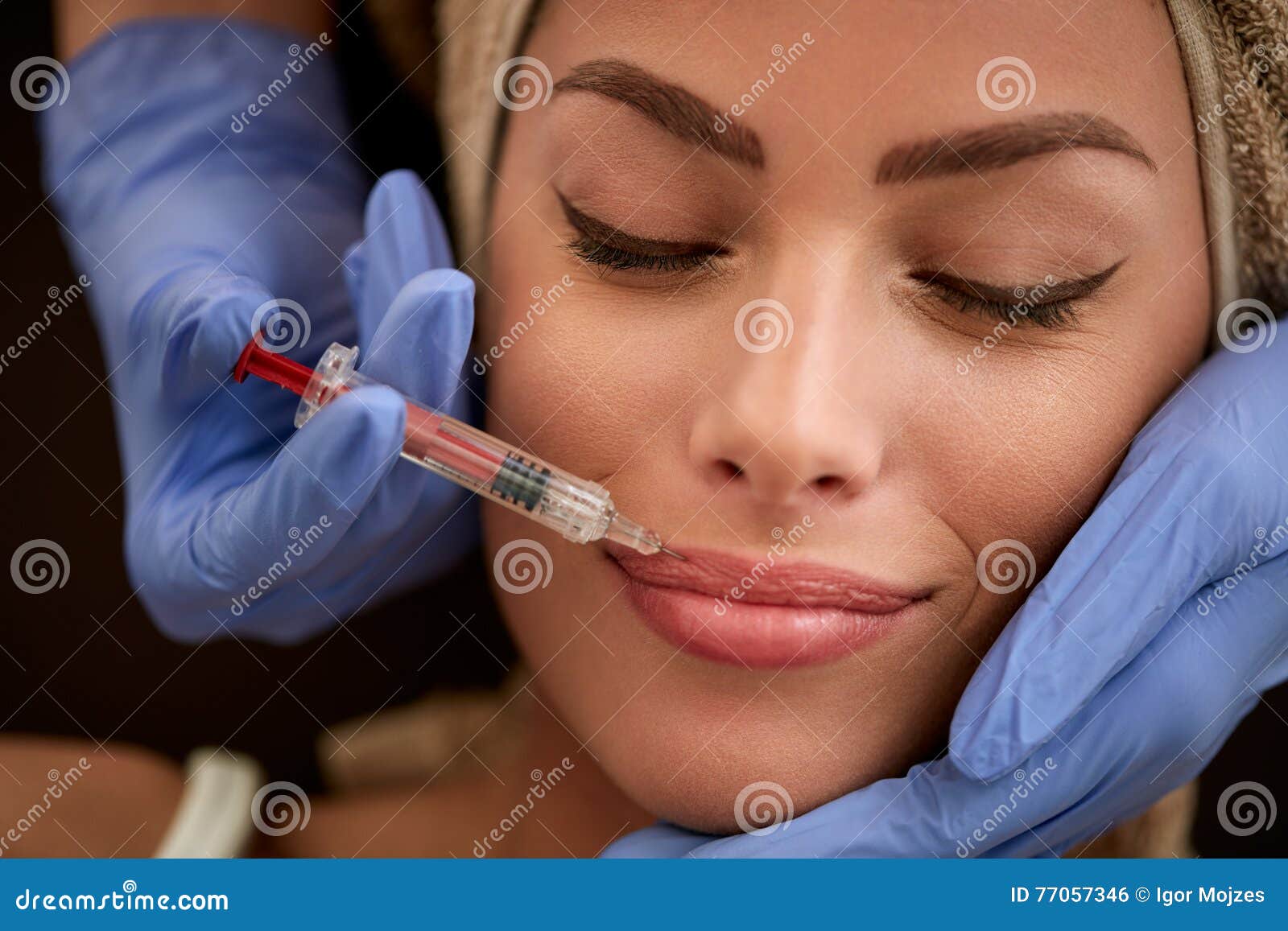 Botox de los labios foto de archivo. Imagen de médico - 77057346