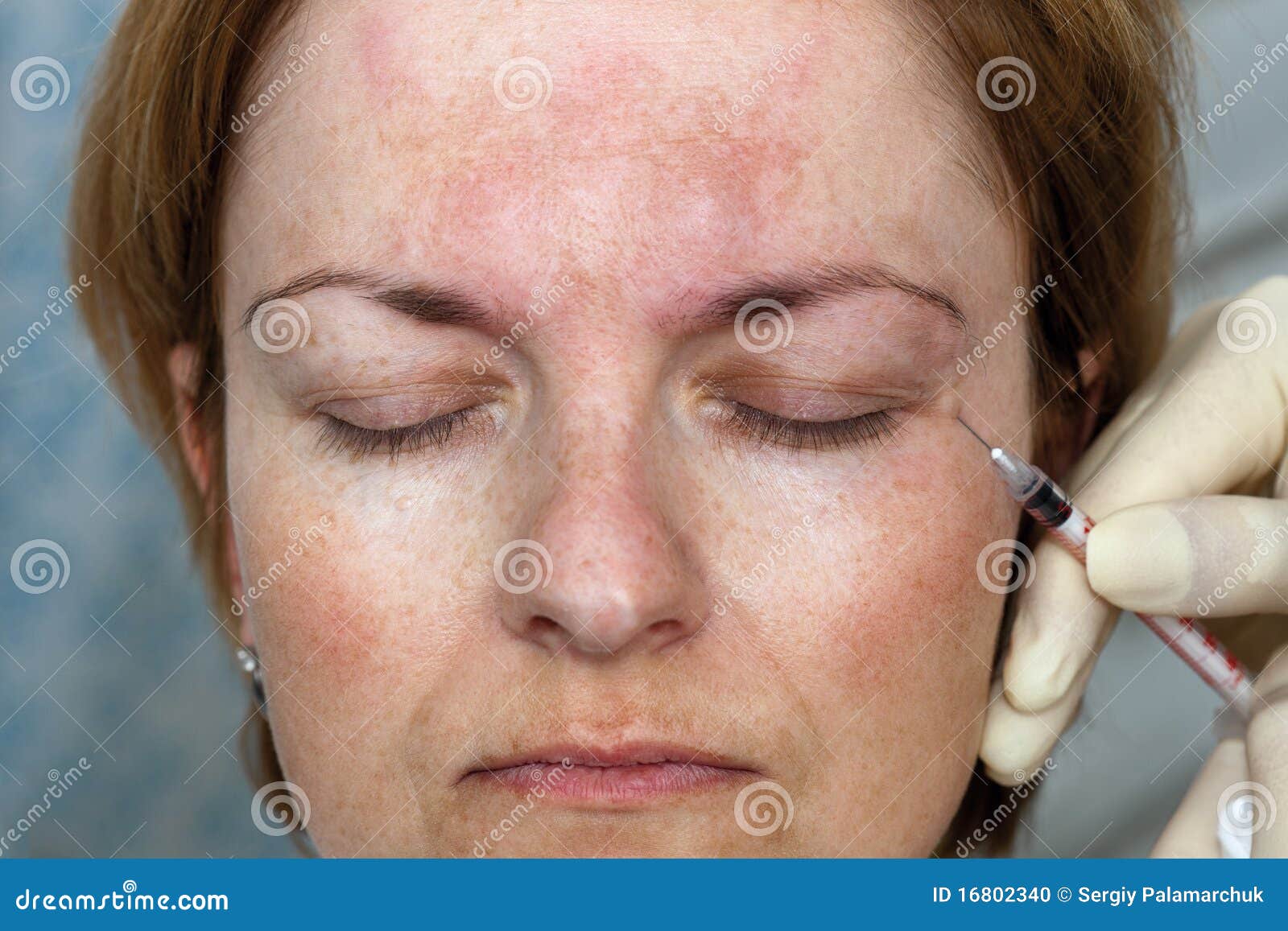 Botox injection stock photo. Image of lifting, isolated - 16802340