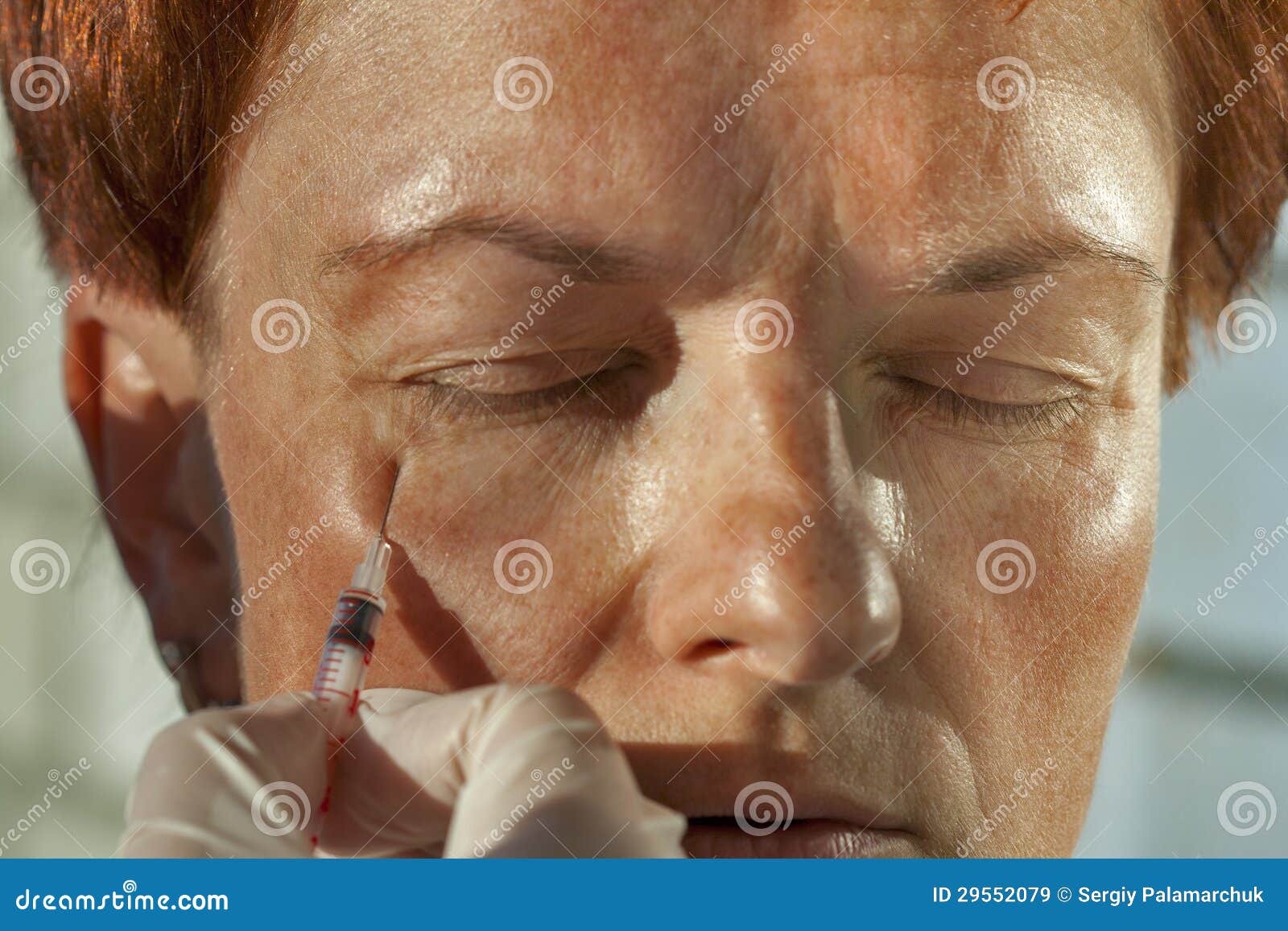 Botox injection stock image. Image of clean, middle, hand - 29552079