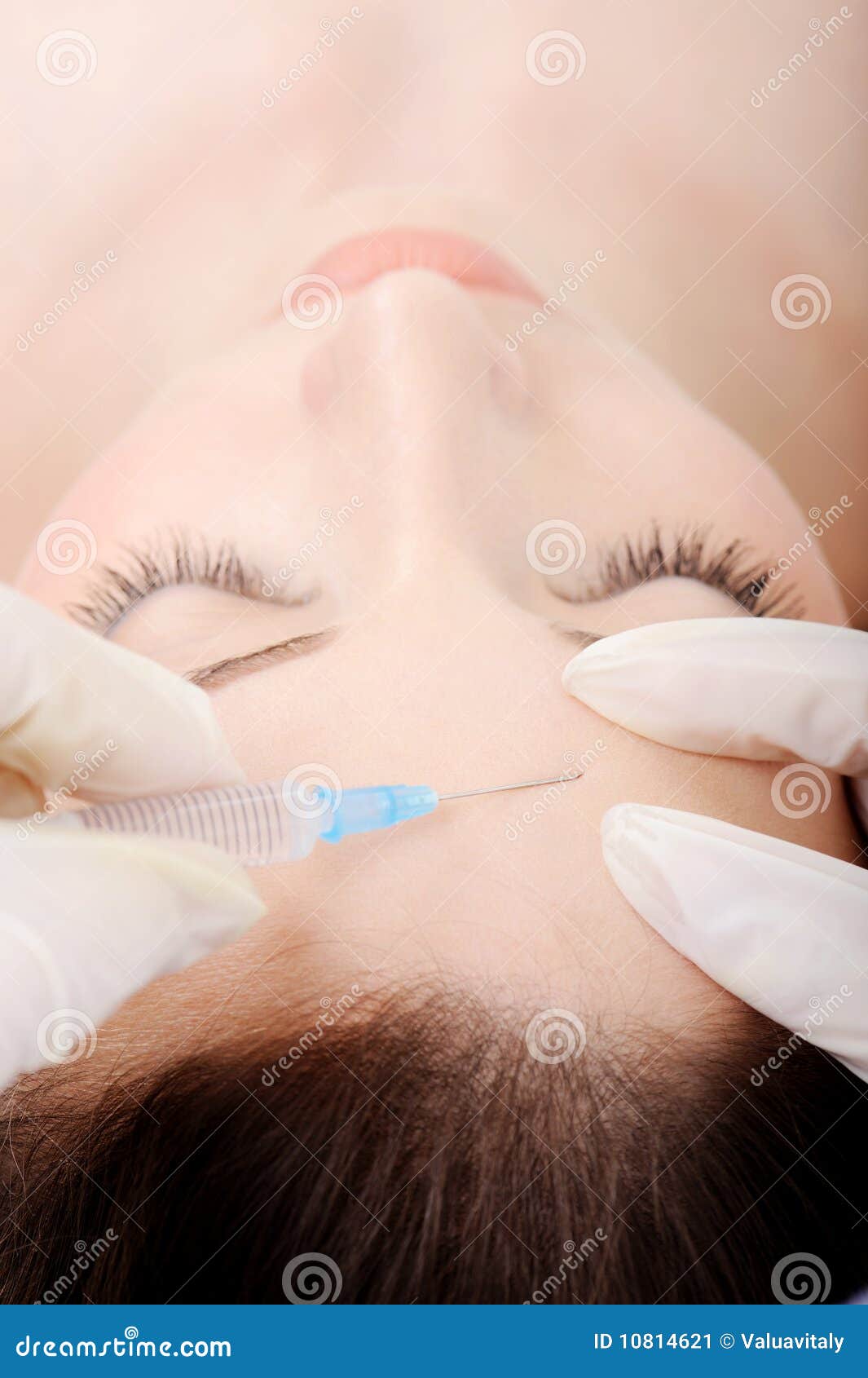 Botox Injection To the Female Forehead Stock Image - Image of skin ...