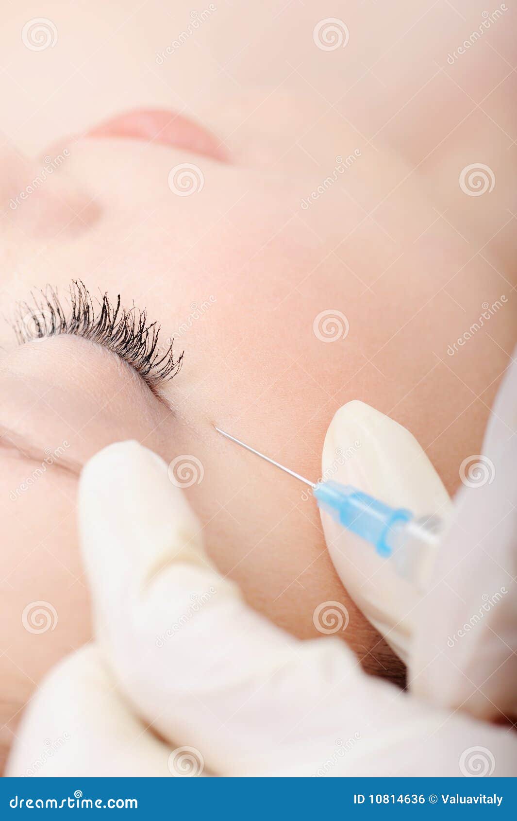 Botox Shot in the Female Face Stock Photo - Image of beautician, macro ...