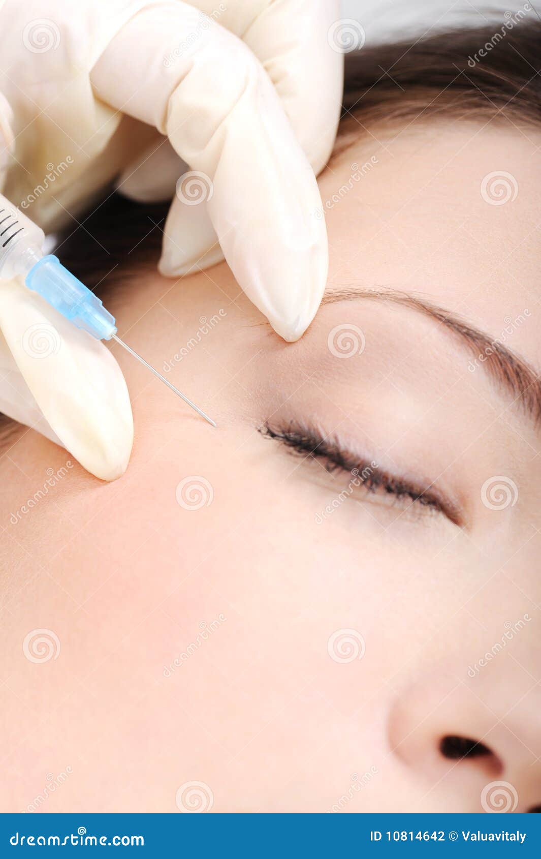 Botox Shot in the Female Face Stock Photo - Image of closed, plastic ...