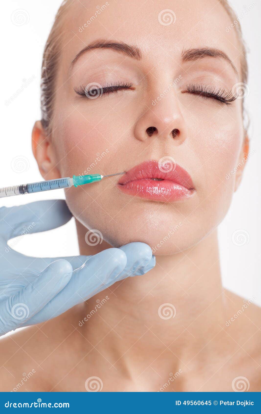 Botox Shot in the Female Lips Stock Image - Image of surgery, clean ...
