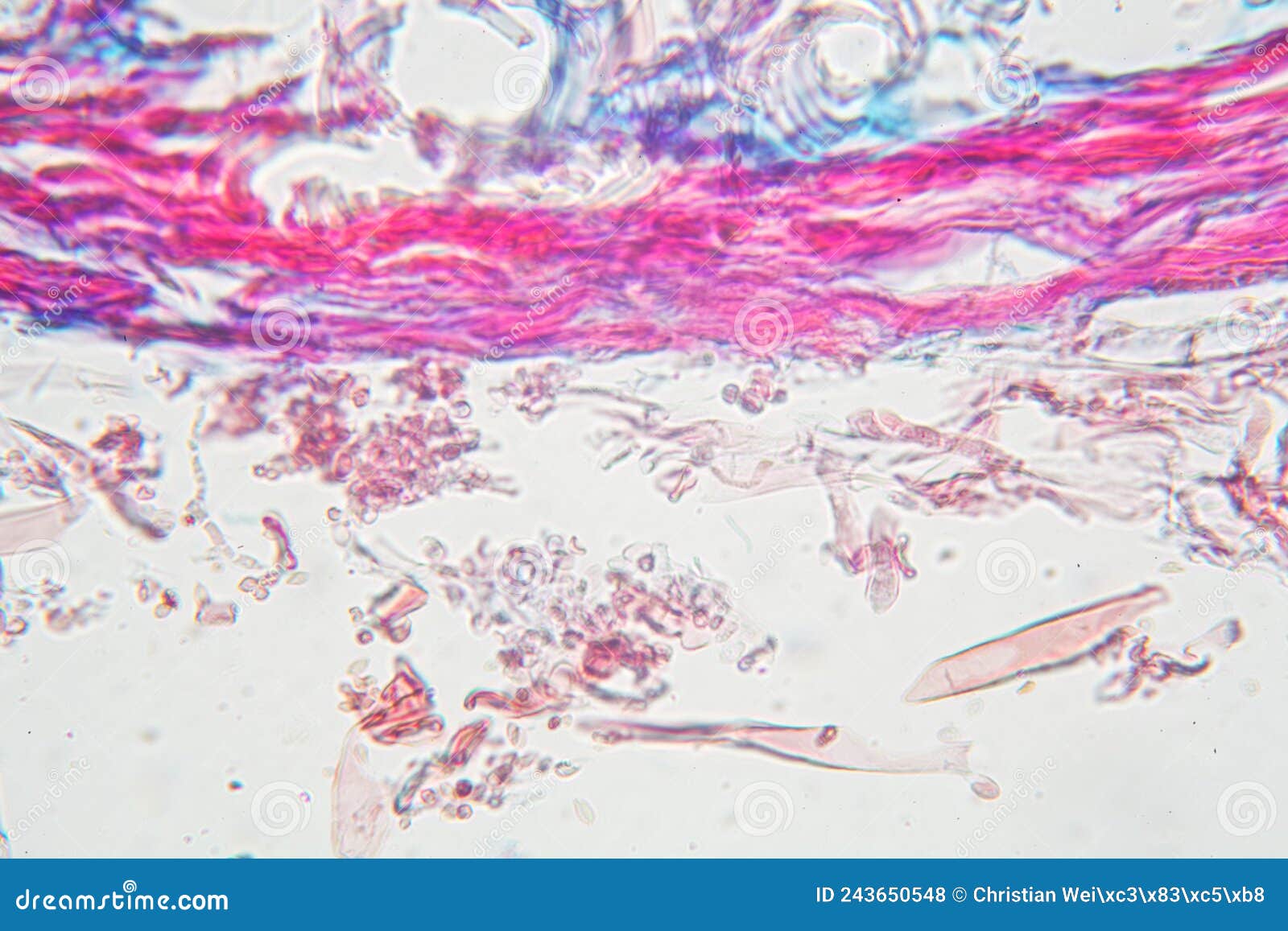 Botrytis Allii Under the Microscope Stock Photo - Image of farming ...