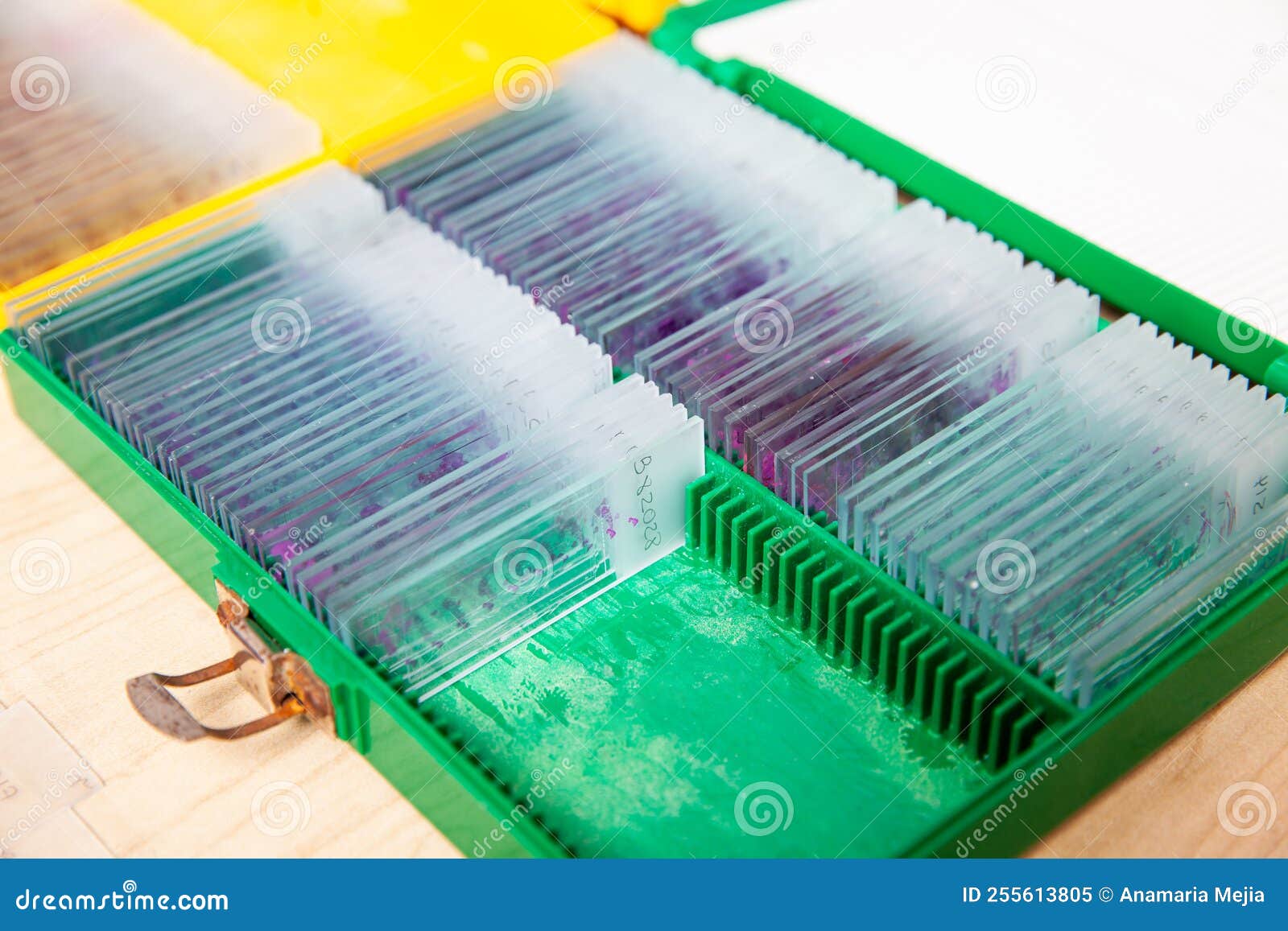 Box of Stained Tissue Biopsy Glass Slides in Pathology Laboratory Stock ...