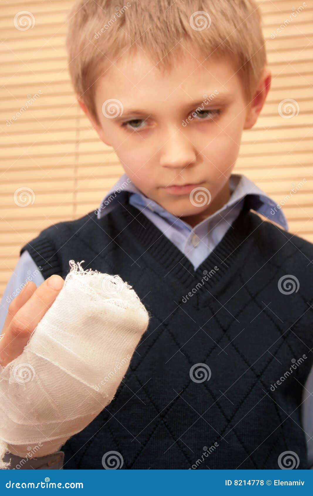 Boy with broken hand. stock photo. Image of clothing, body - 8214778