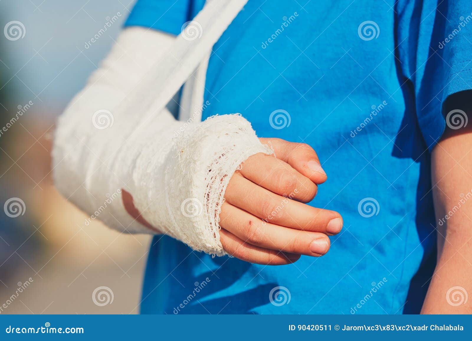 Boy with broken hand stock image. Image of bandage, accident - 90420511