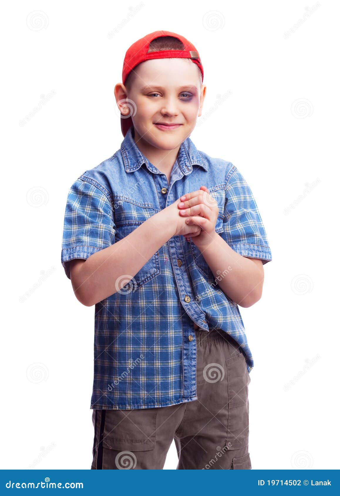 Boy with a bruise stock photo. Image of childhood, people - 19714502