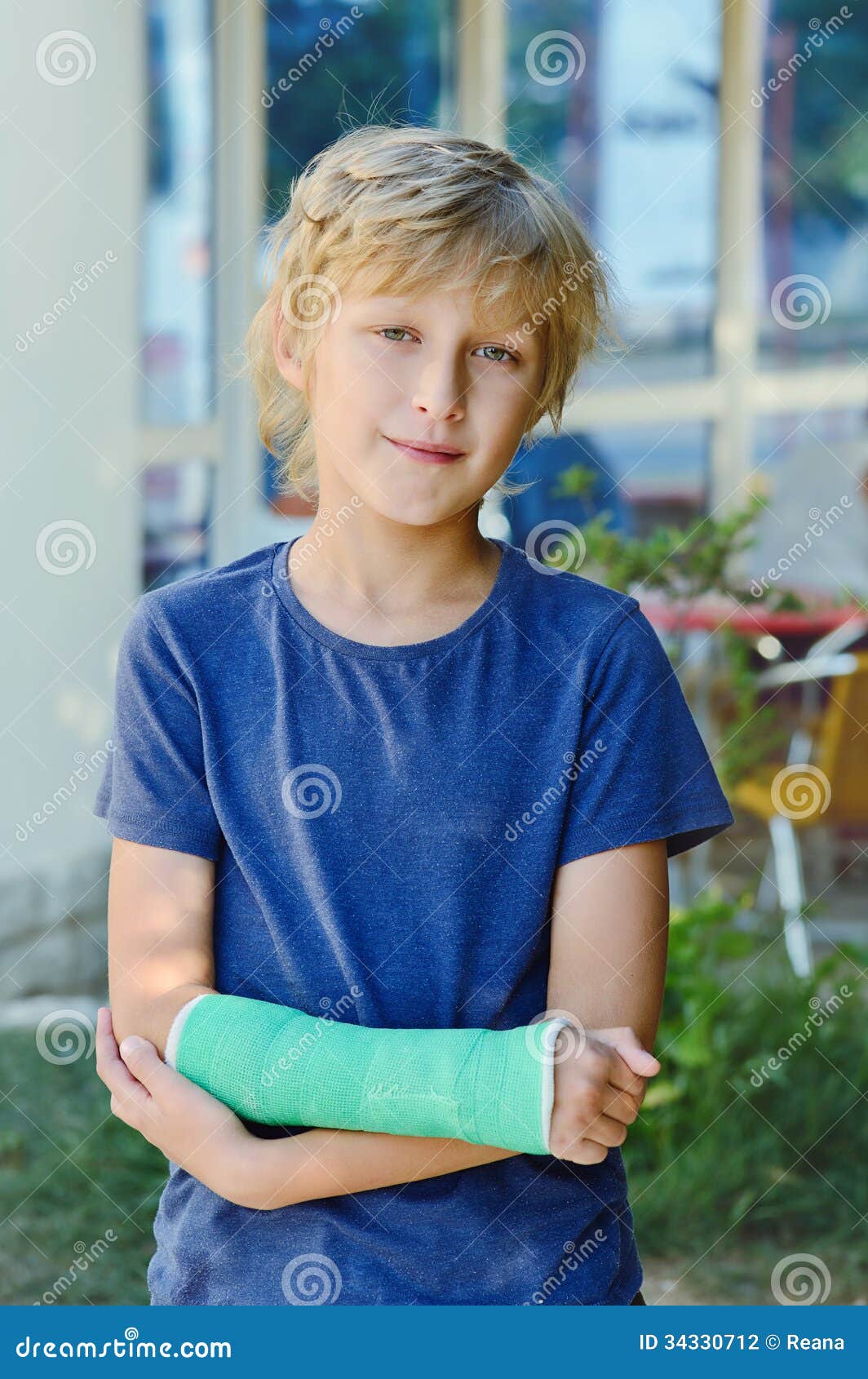 Boy with cast stock photo. Image of medical, accident - 34330712