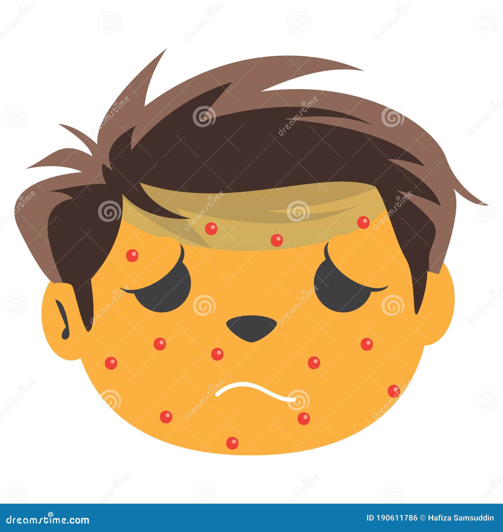 Boy with Chicken Pox. Vector Illustration Decorative Design Stock ...