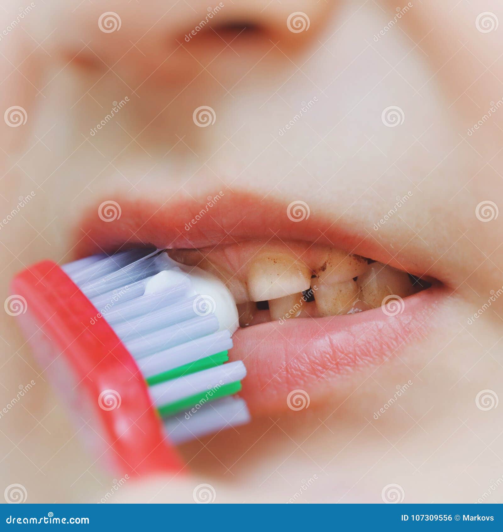 Boy Cleans Dirty Teeth with a Toothbrush. Macro Shooting Stock Photo ...