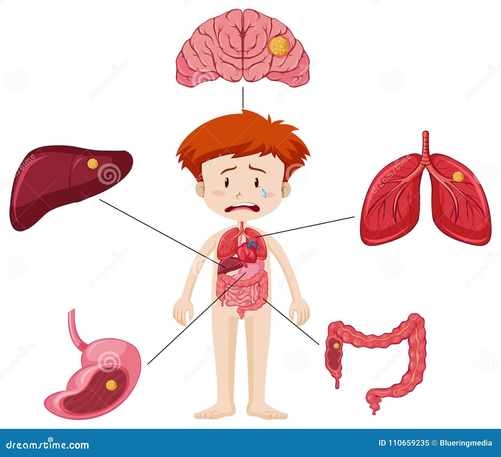 Boy and Diagram Showing Different Parts of Organs with Disease Stock ... Boy and Diagram Showing Different Parts of Organs with Disease Stock ...