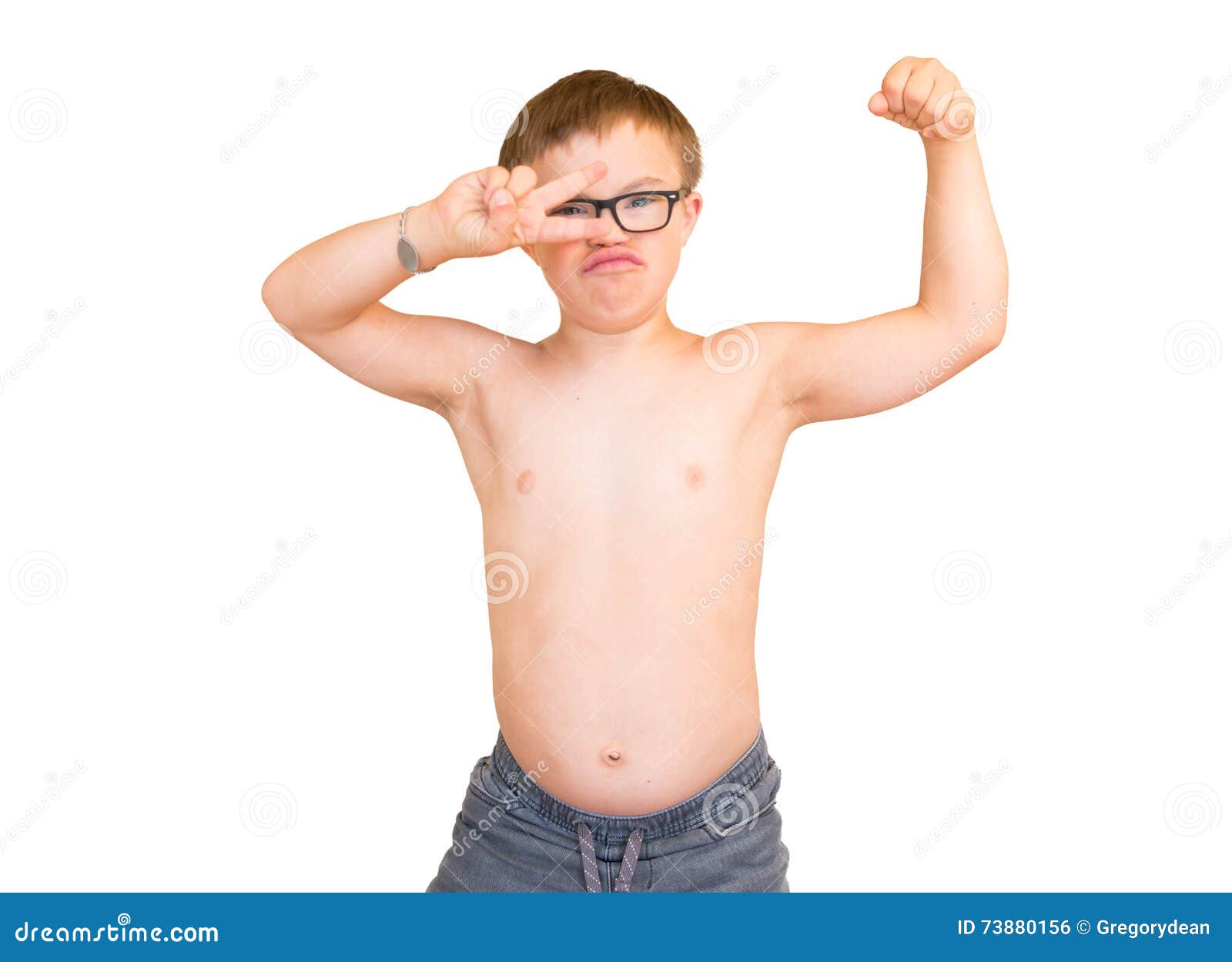 Boy with Downs Syndrome Flexing His Muscles Stock Photo - Image of ...